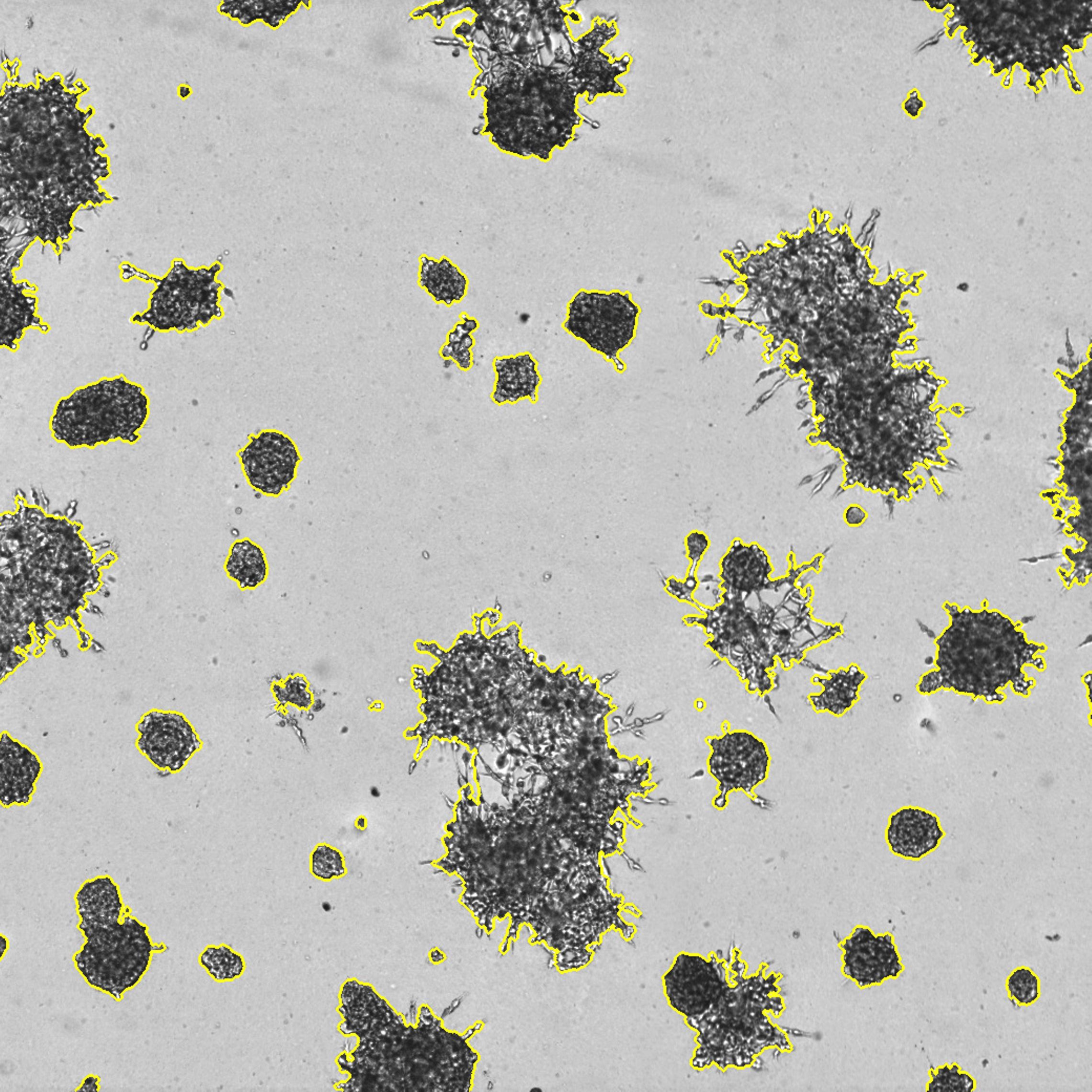 Multi-Spheroid Assays | Sartorius