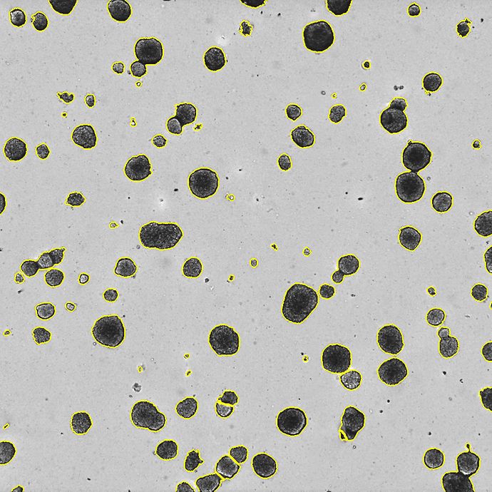 Incucyte Spheroid Analysis Software | Sartorius