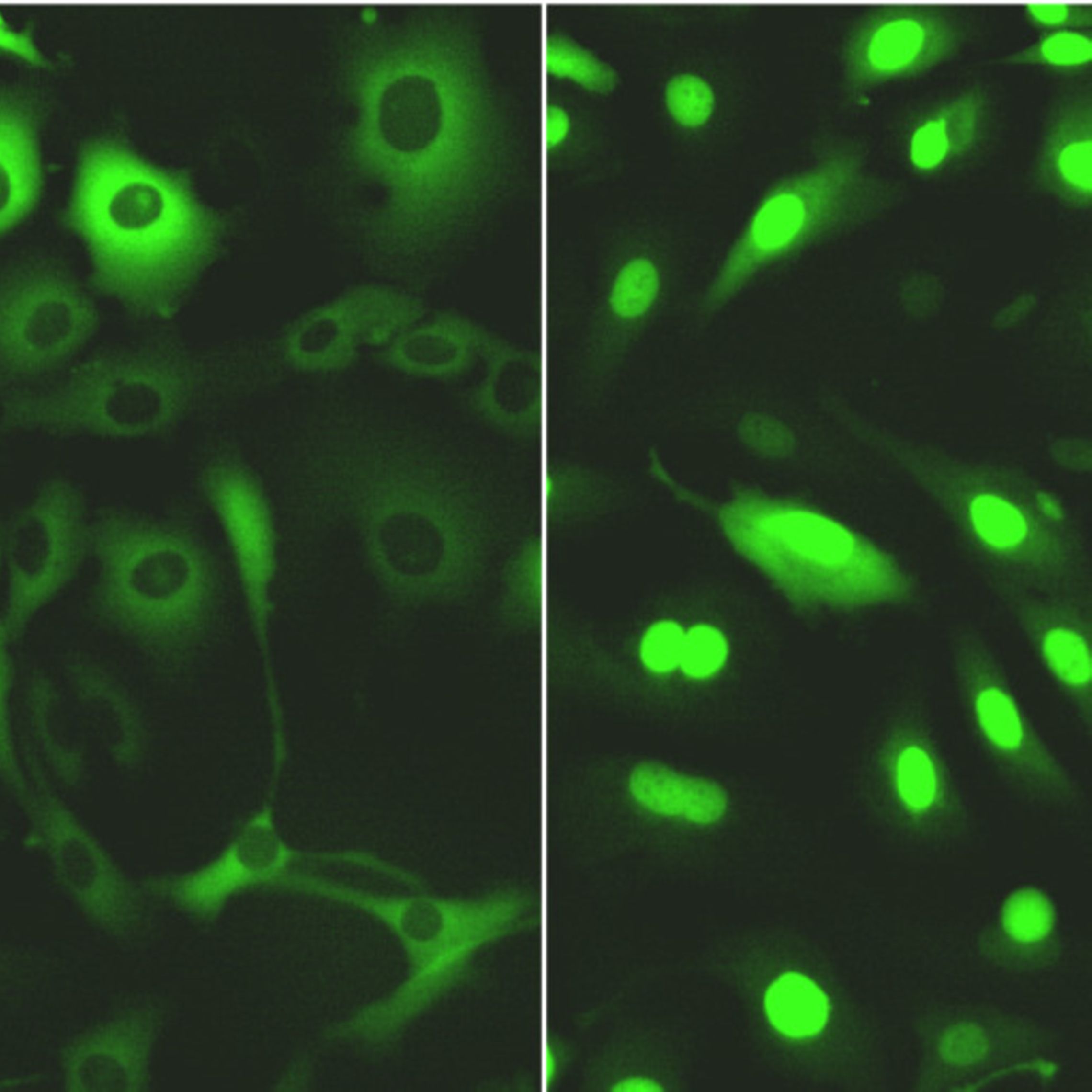 Kinase Activity Assay