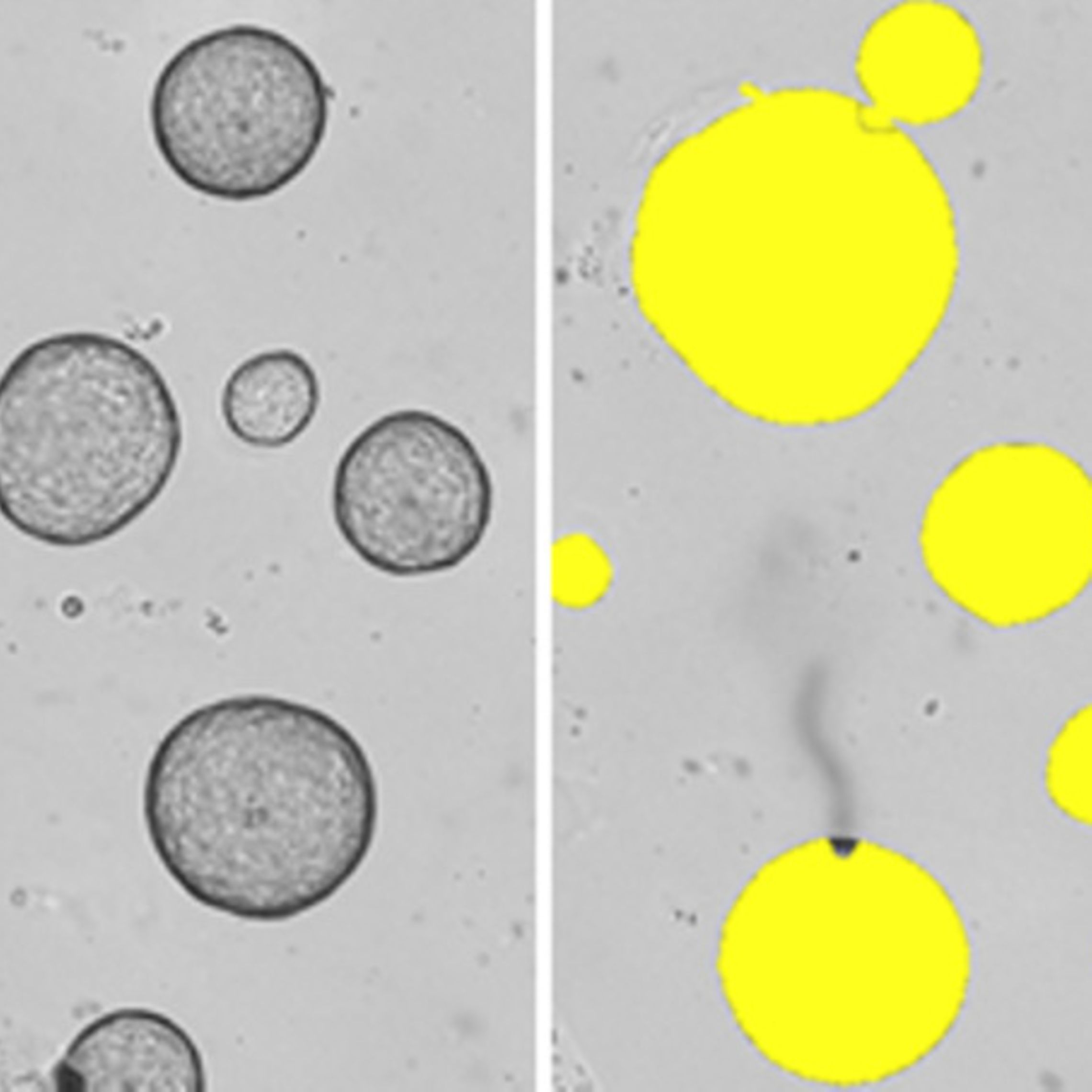Studying 3D Organoids with Live-Cell Analysis Webinar | Sartorius