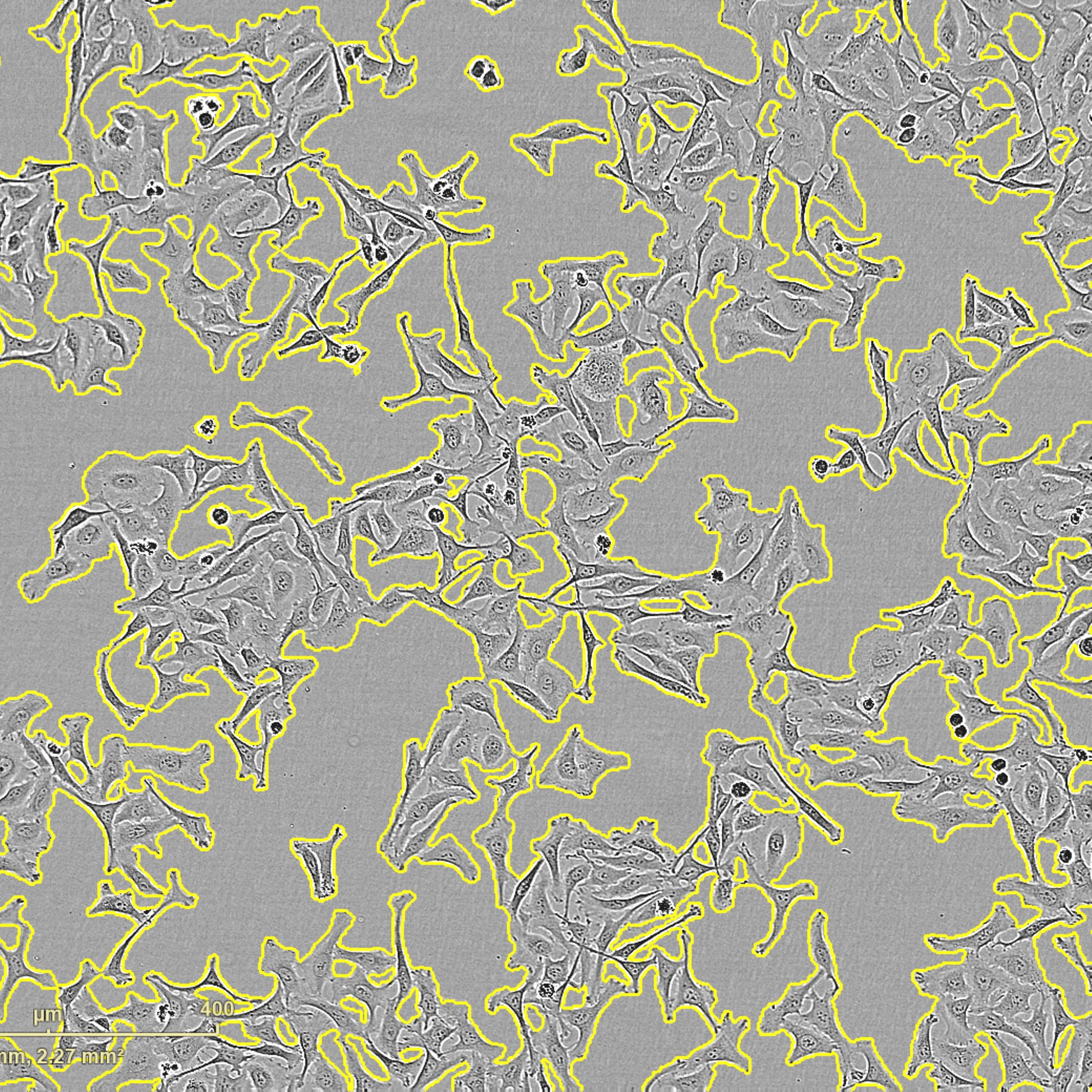 Cell Proliferation Assays for Live-Cell Analysis | Sartorius