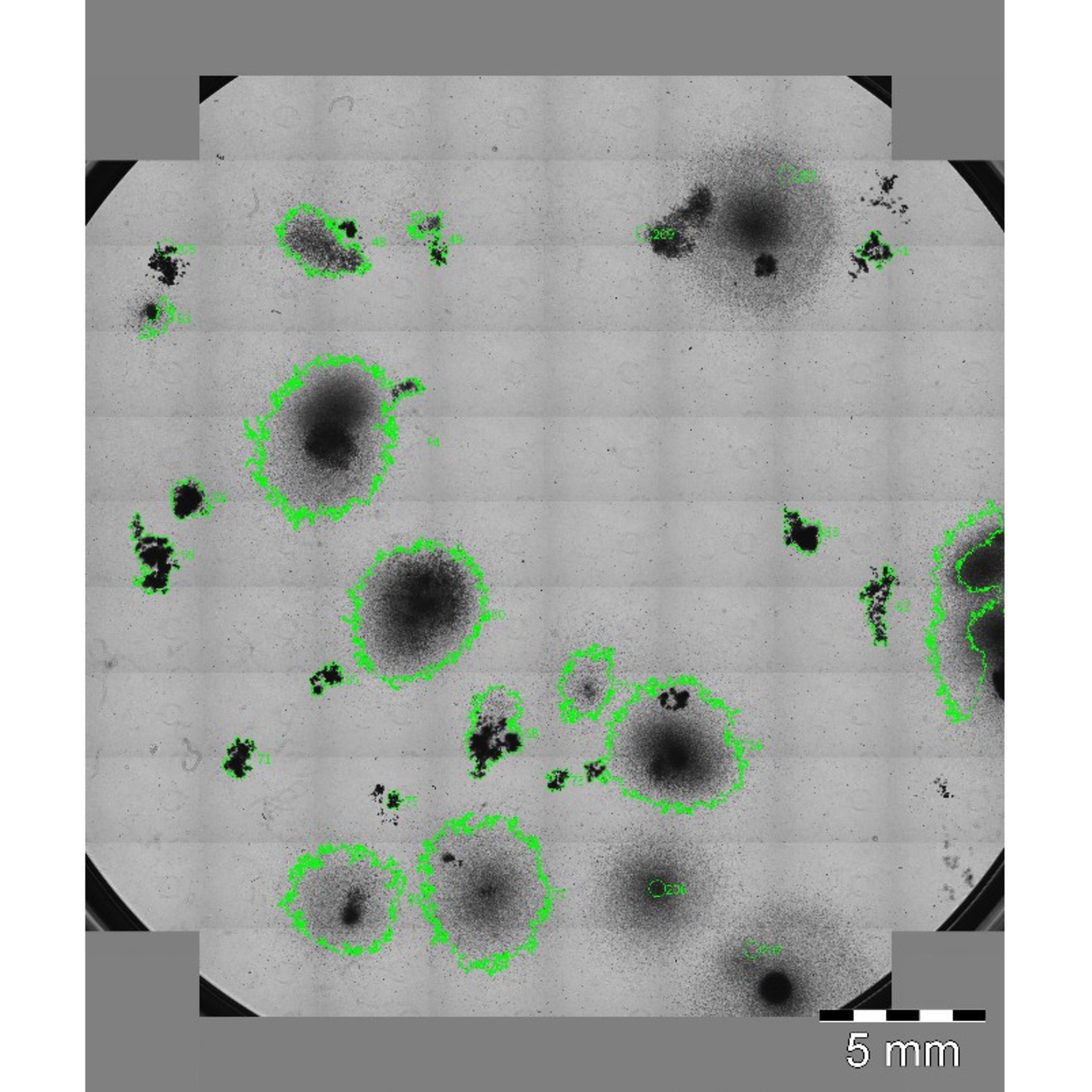 Hematopoietic Stem Cell Colonies | Sartorius