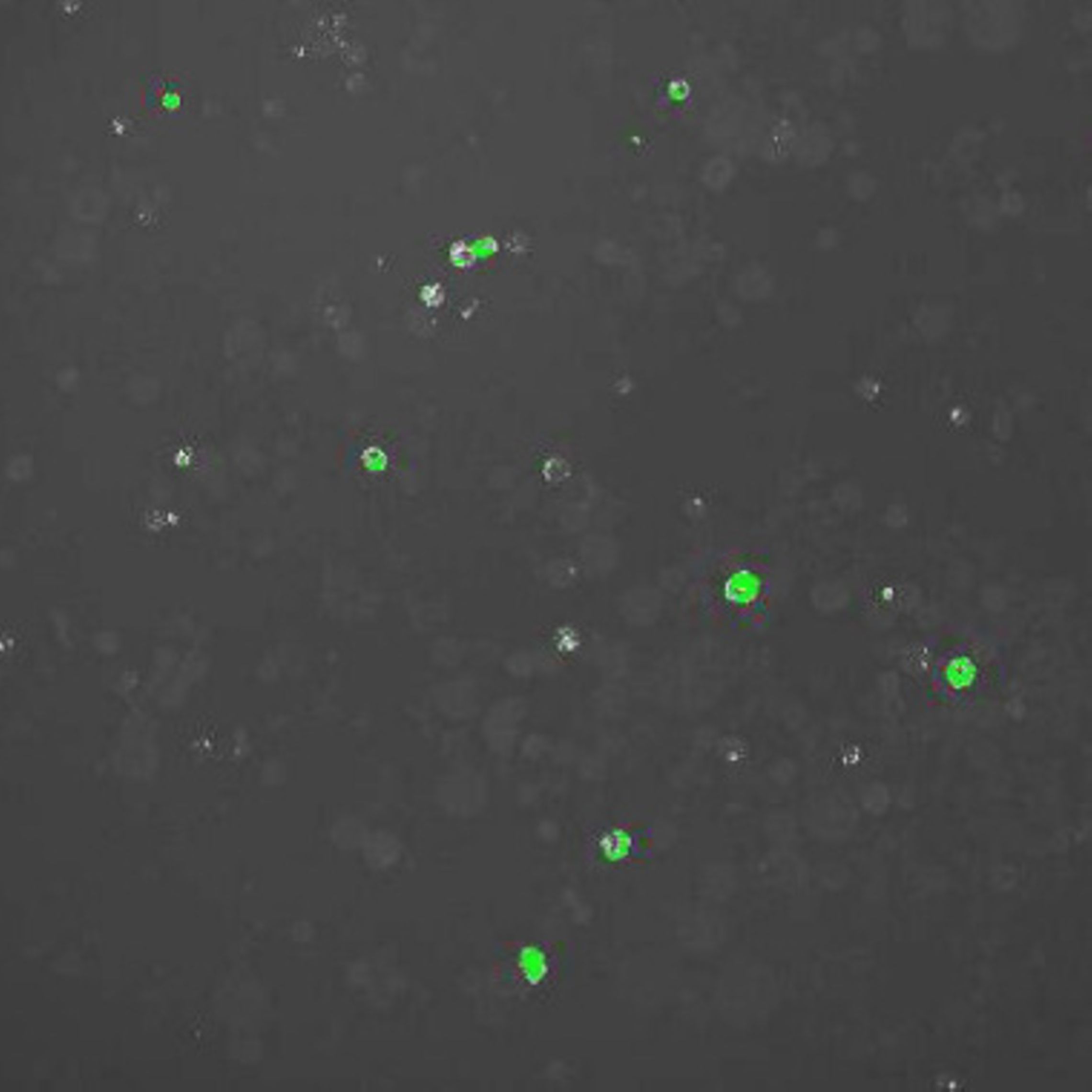Protoplasts - Plant Cells | Sartorius