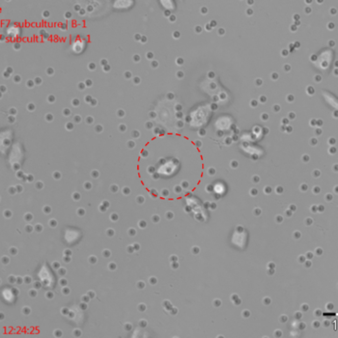 Single Cell Heterogeneity Analysis | Sartorius