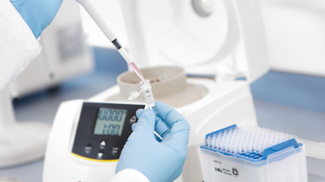 Protein DNA Concentration Ultrafiltration Devices | Sartorius