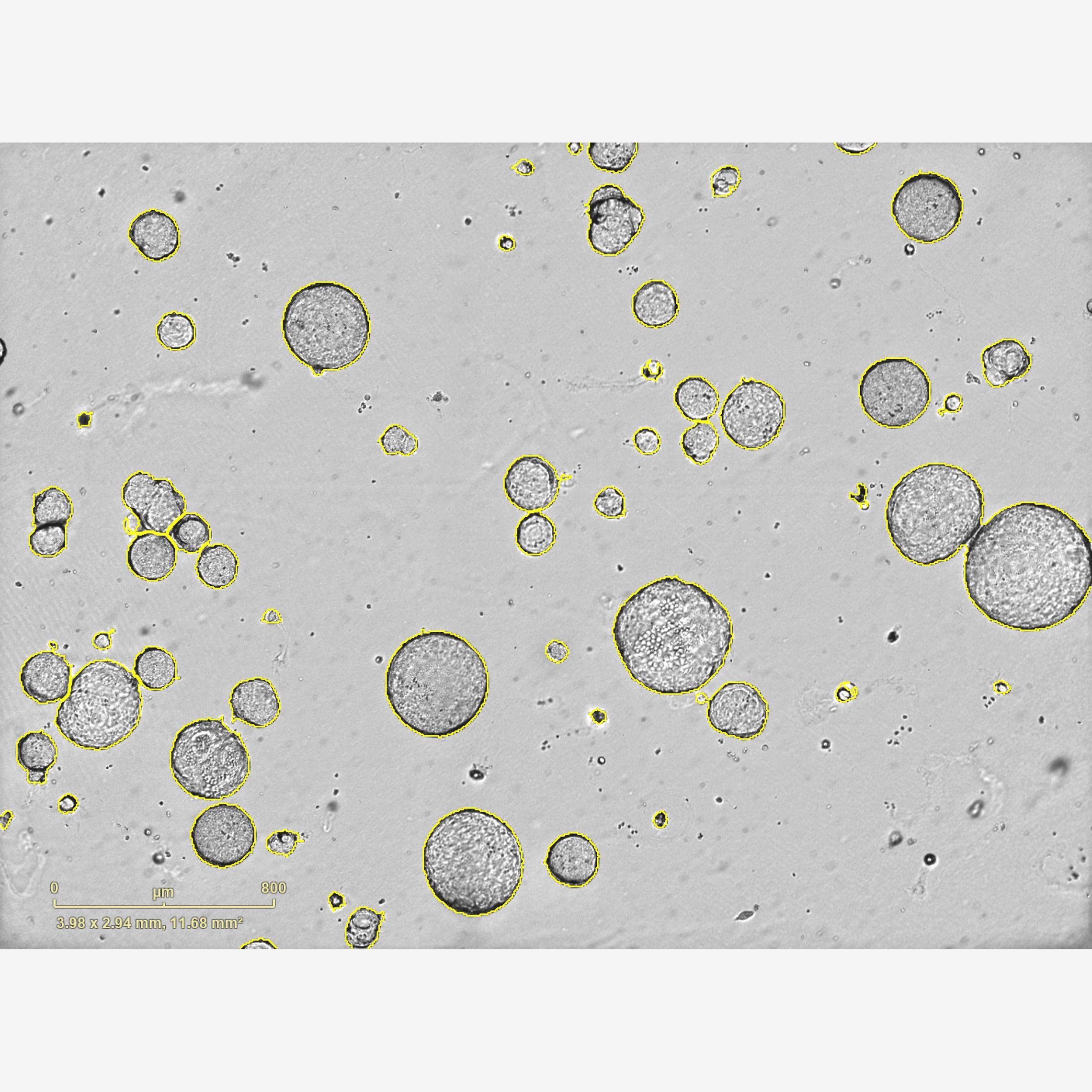 Real-time Live-Cell Analysis of 3D Organoid Growth in Matrigel® Domes ...