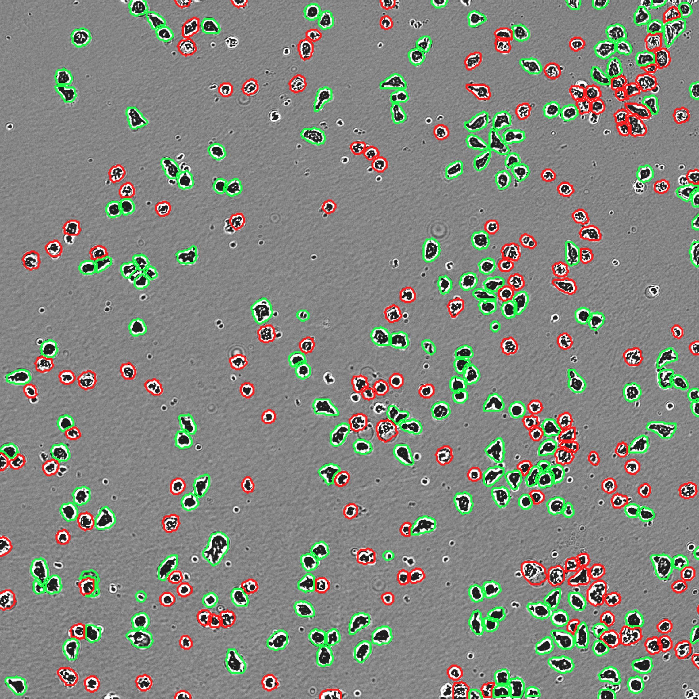 Incucyte® AI Cell Health Analysis Software Module | Sartorius