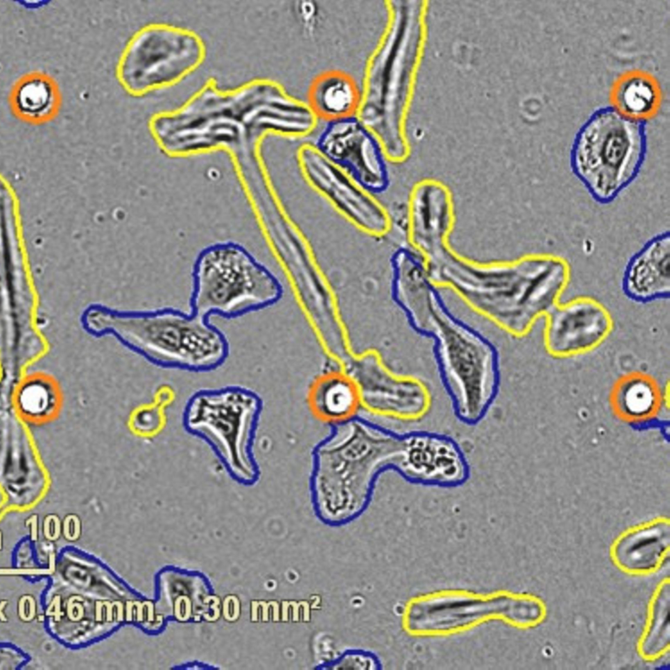 Chemotactic Migration and Invasion Assays | Sartorius