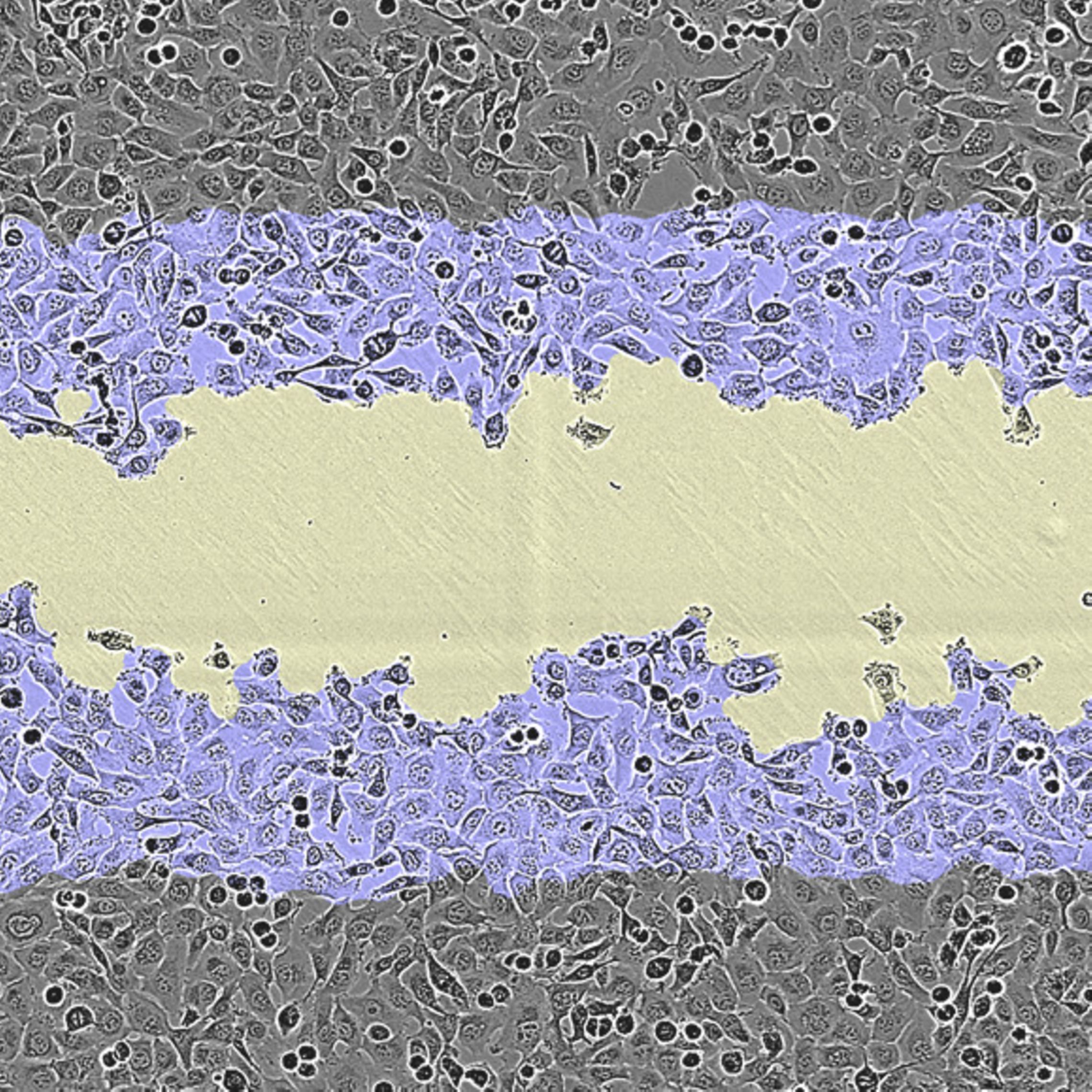 Scratch Wound Migration & Invasion | Sartorius