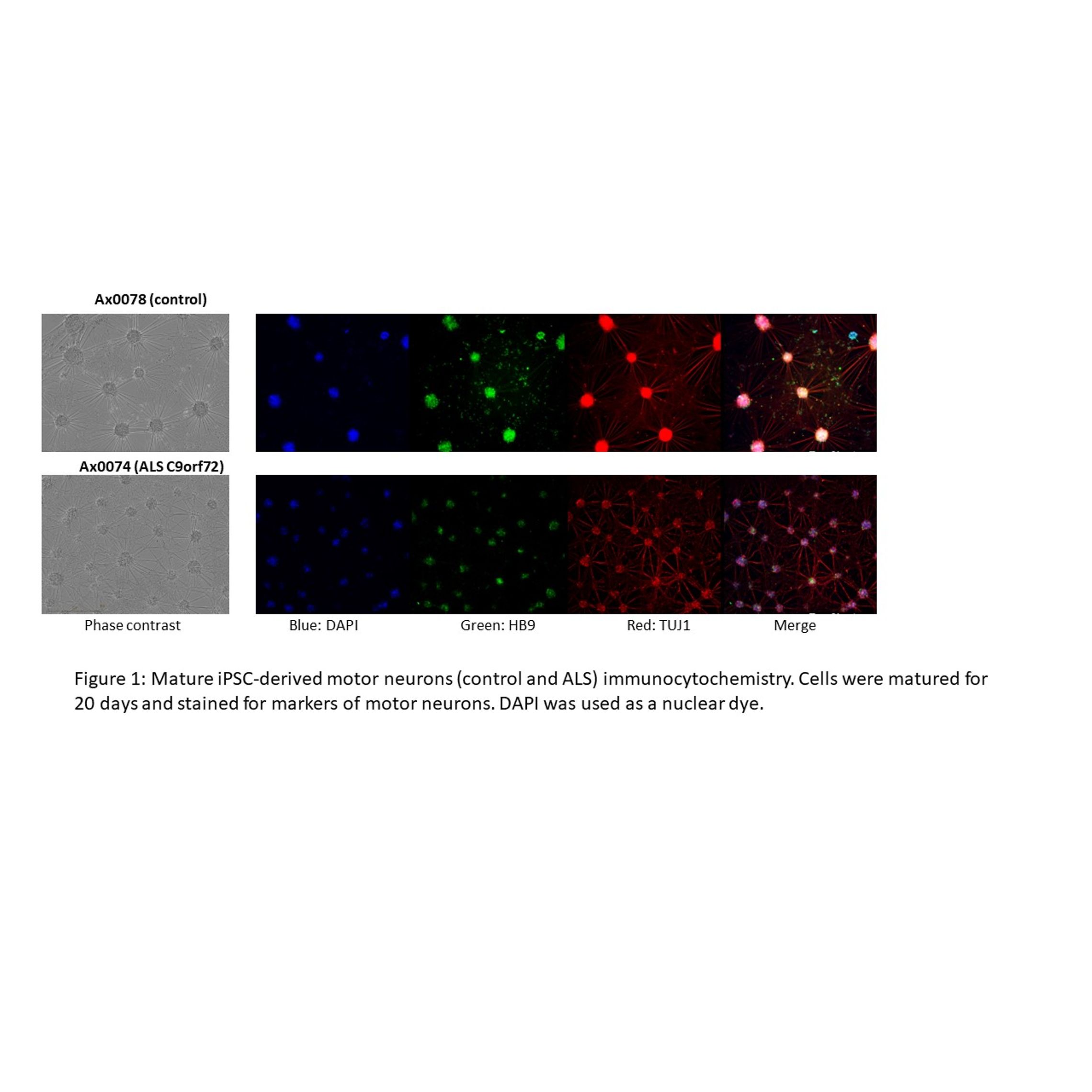 iPSC-Derived Motor Neurons and Microglia from ALS Background Display ...
