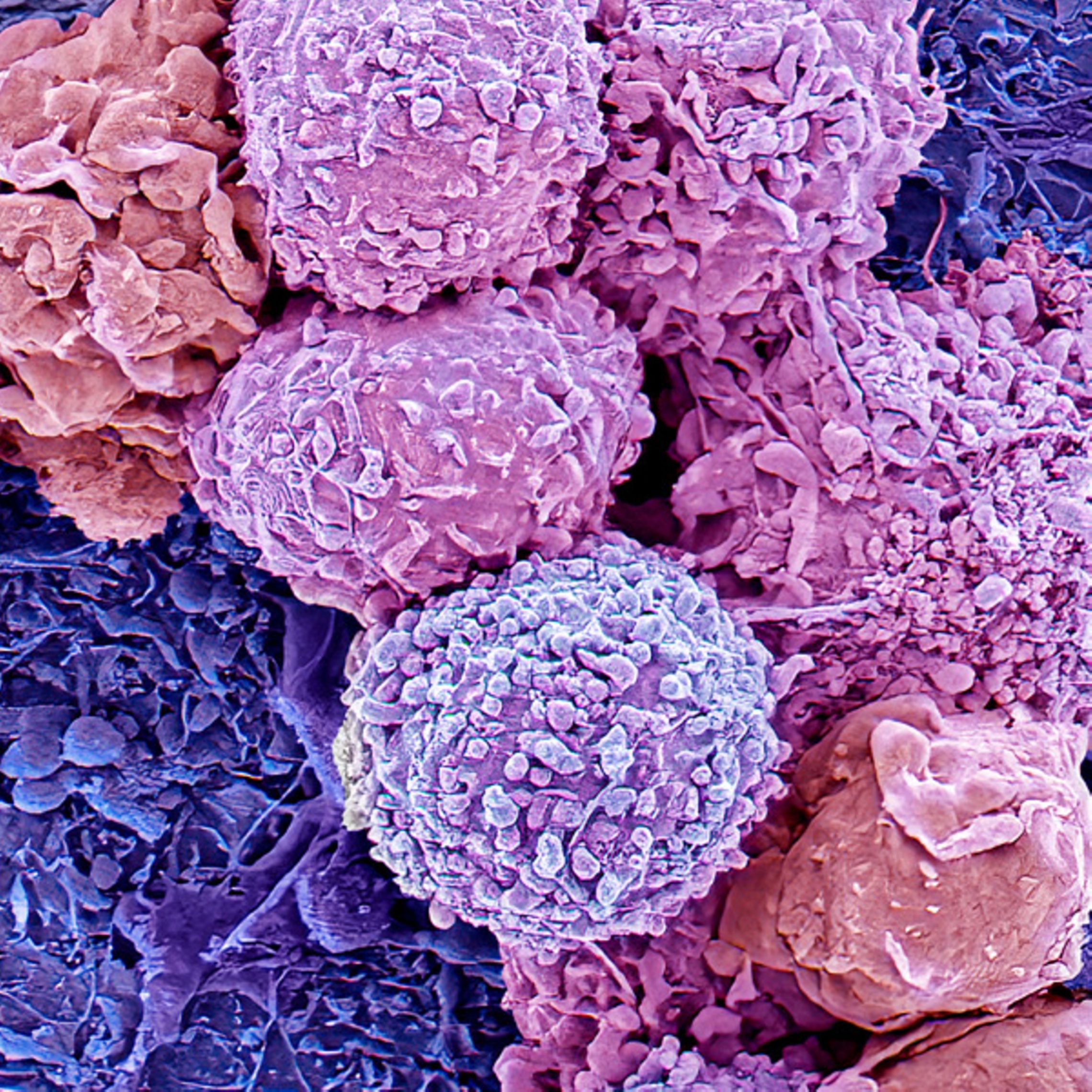 Stem Cell Therapy | Sartorius