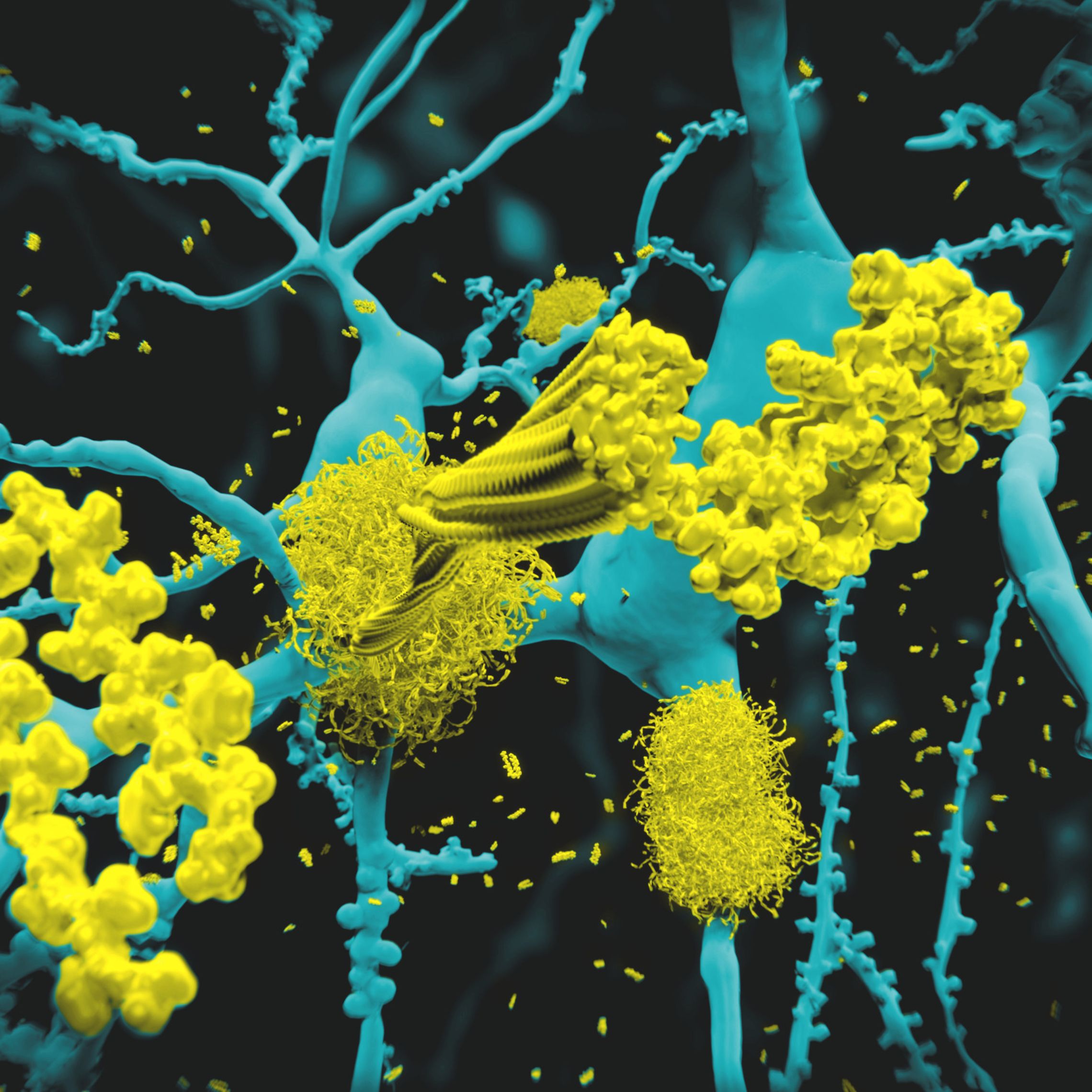 Protein Crystallography in Alzheimer’s Research | Sartorius