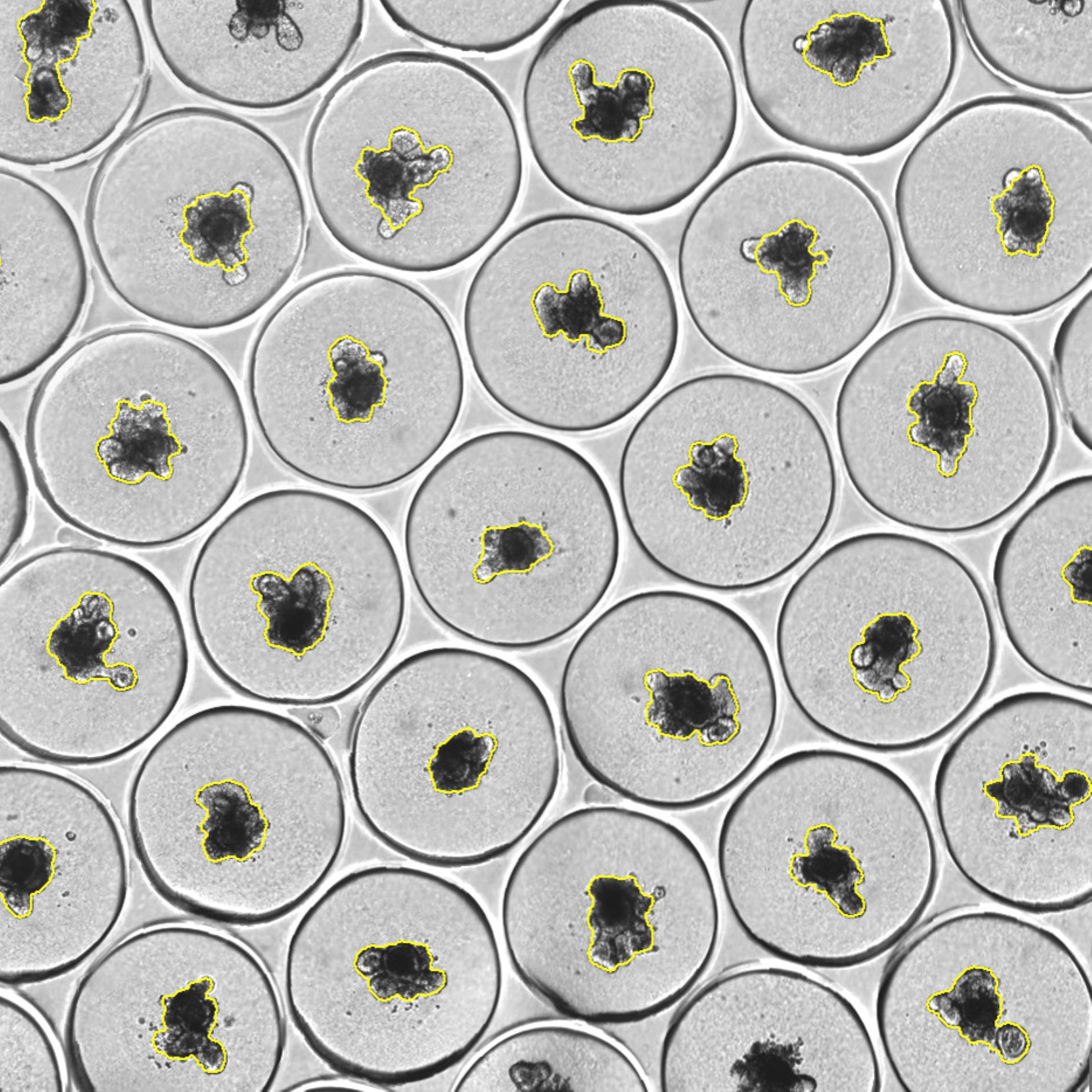 Organoid Assay | Sartorius