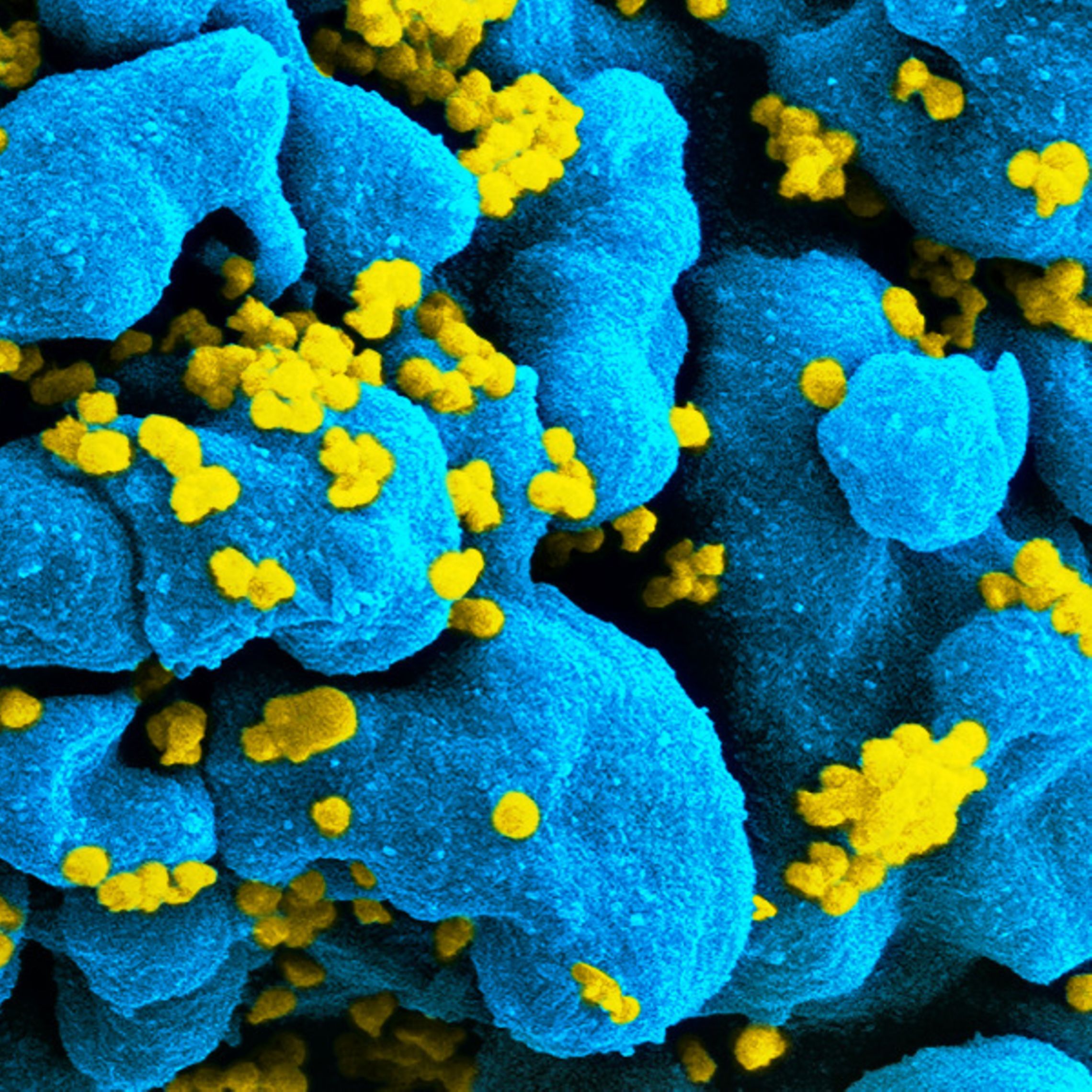 Lentiviral Gene Therapy | Sartorius