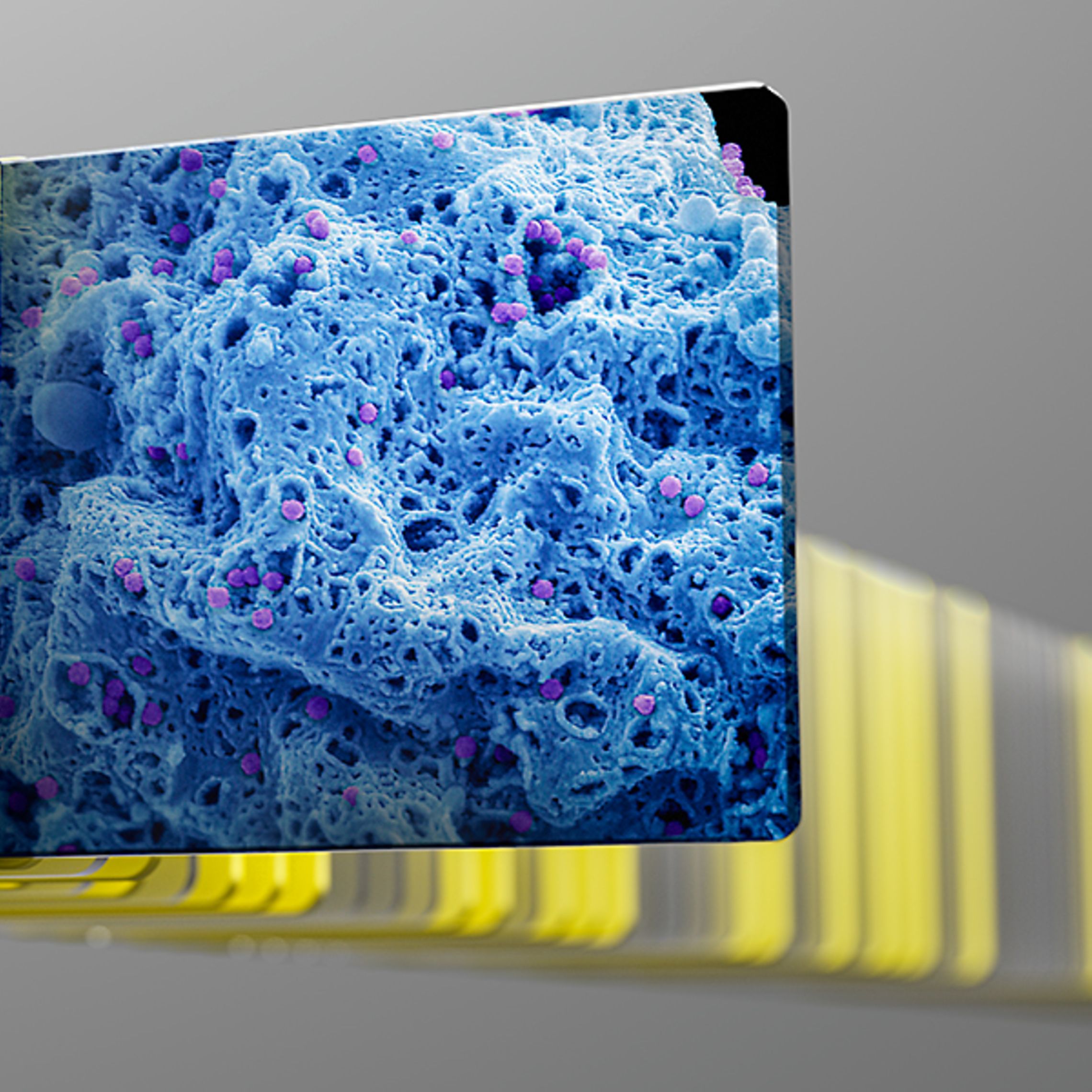 Enabling a Robust AAV Upstream Platform | Sartorius