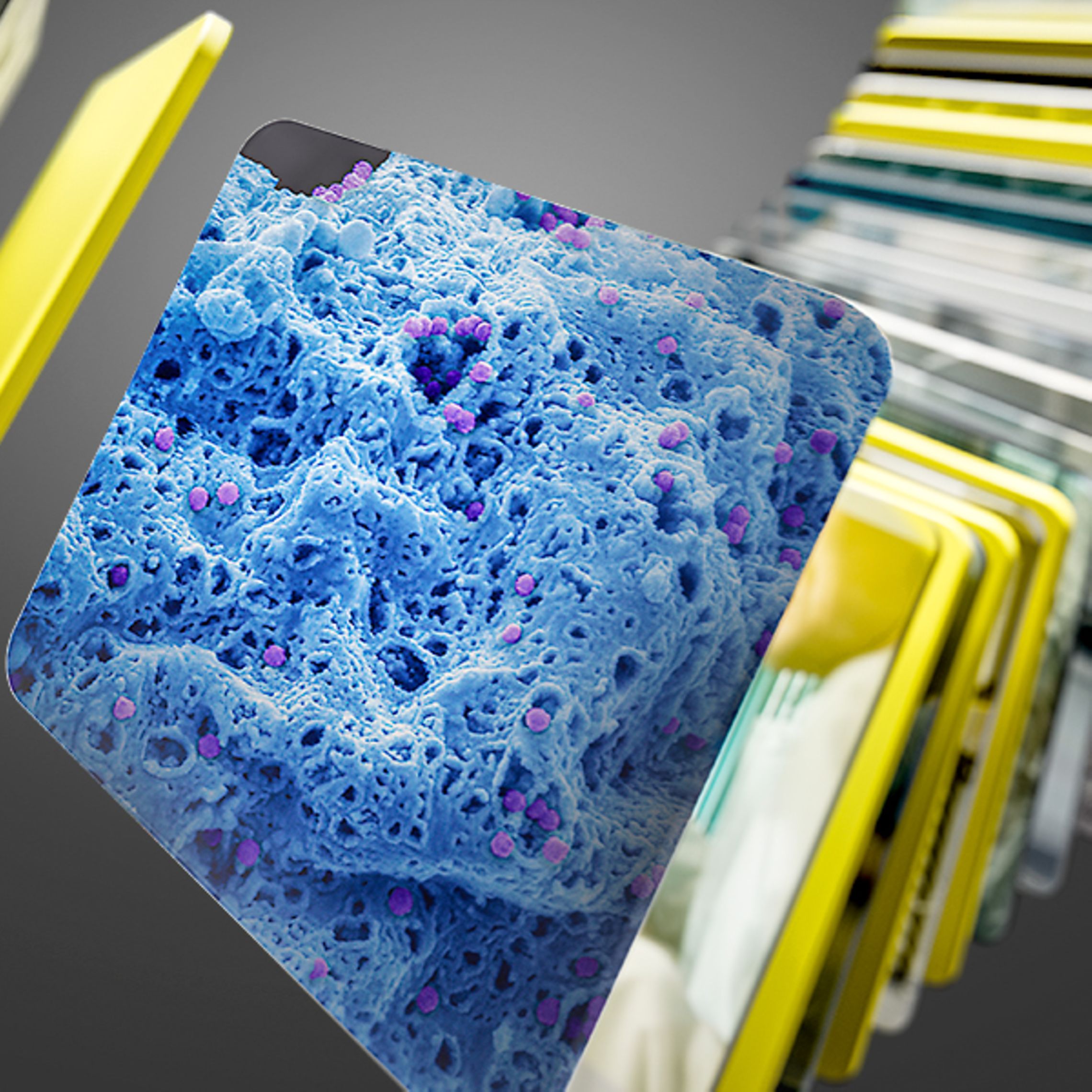 Webinar: Showcasing a Scalable Downstream Platform for Multiple AAV Serotypes | Sartorius