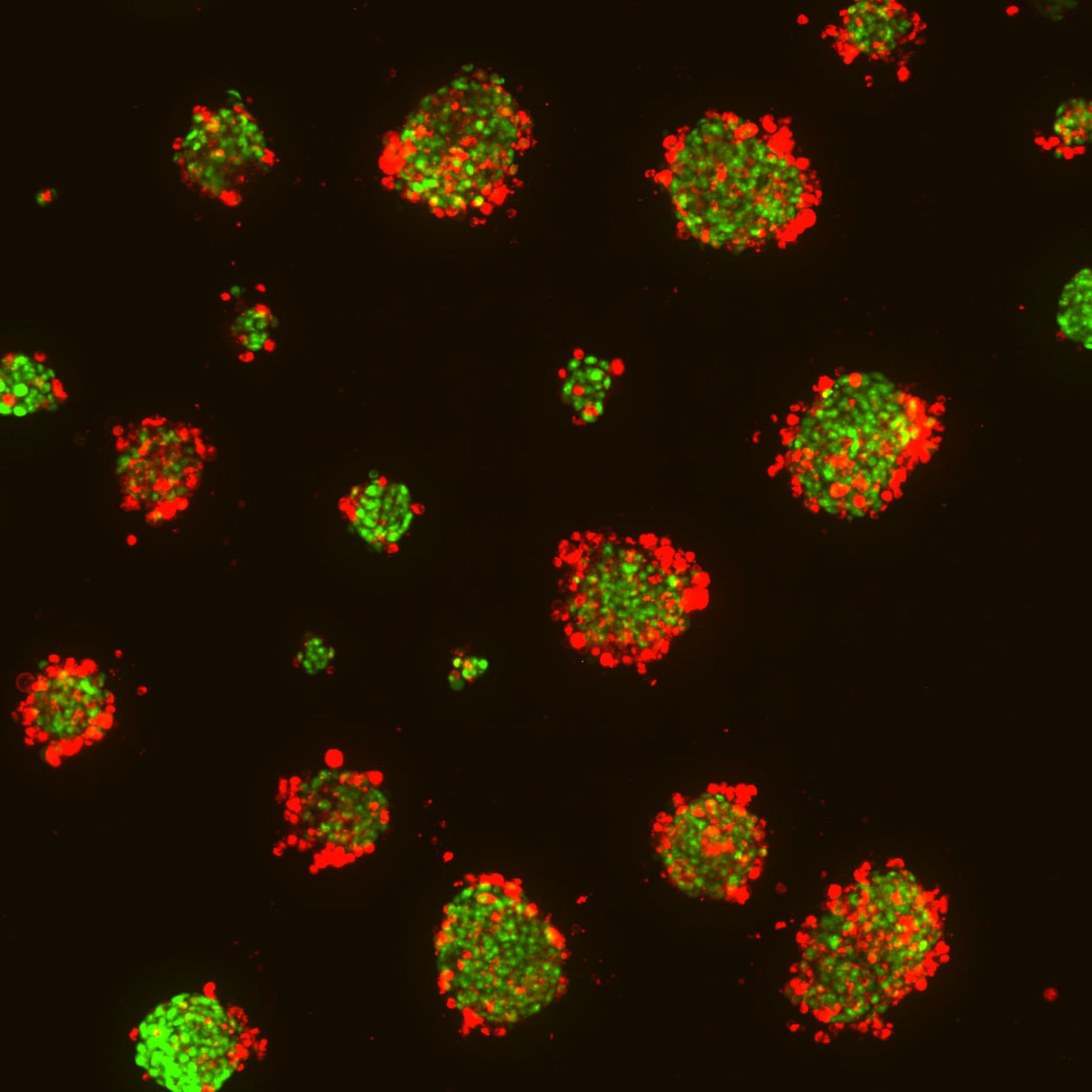 Incucyte Spheroid Analysis Software | Sartorius