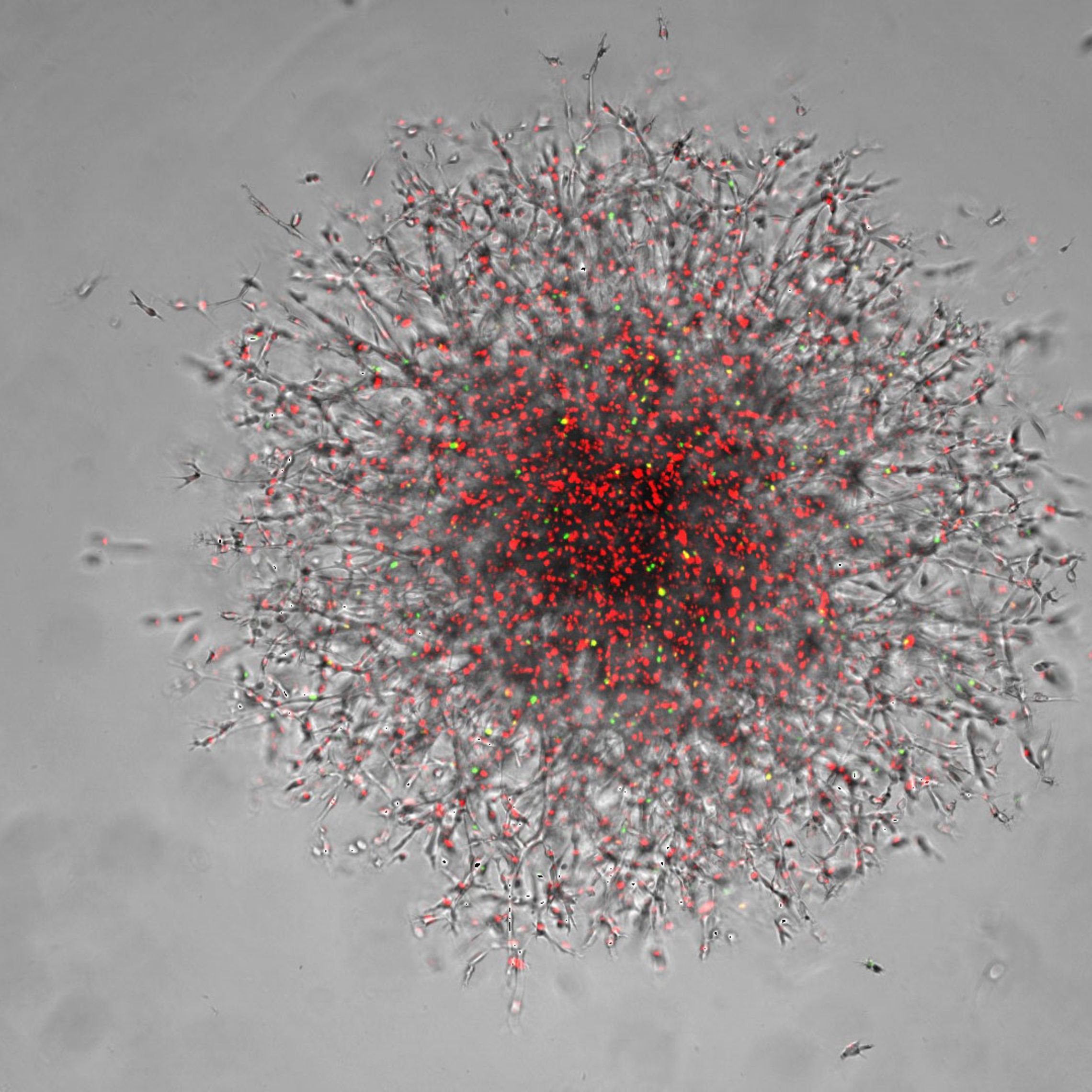 Spheroid Invasion | Sartorius