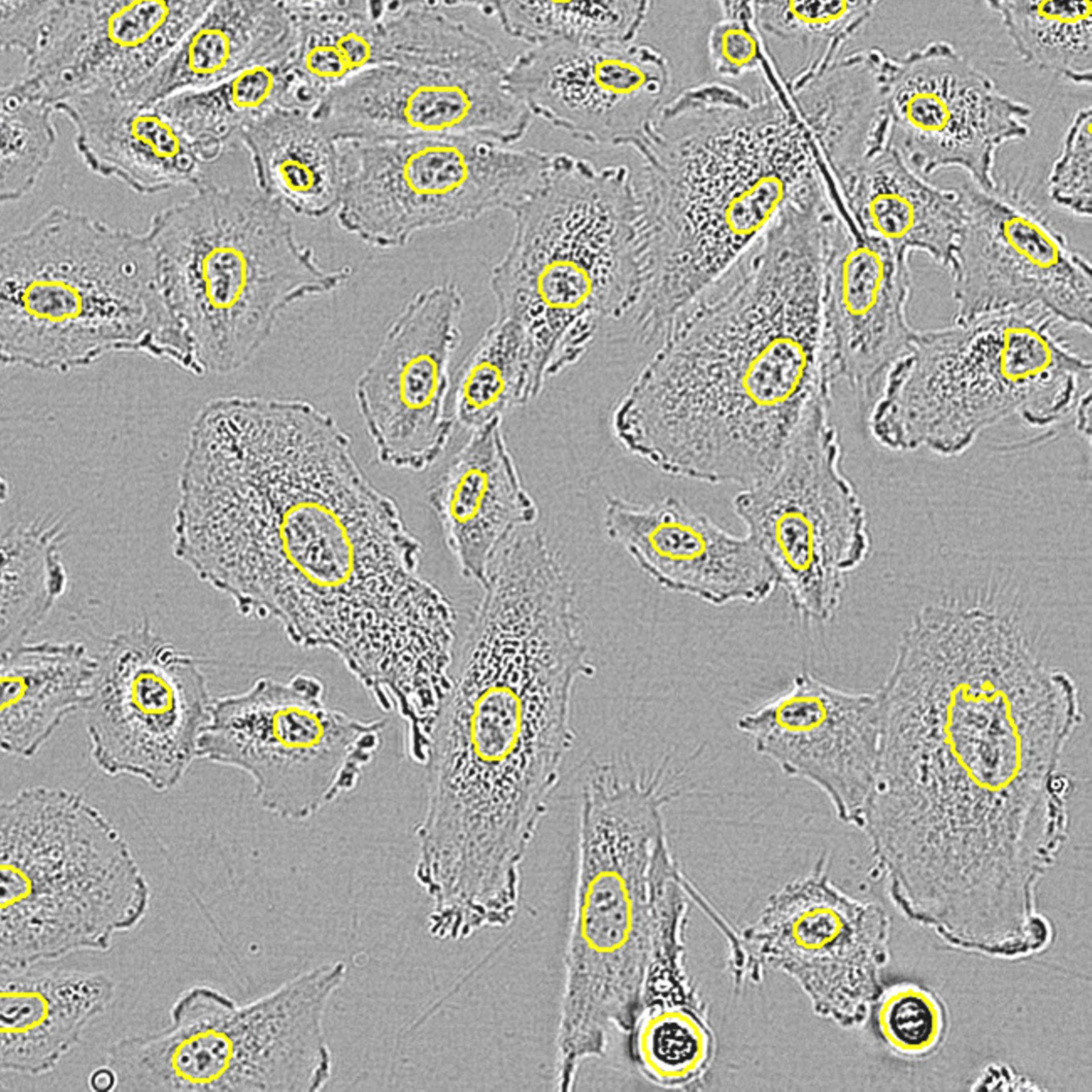 Incucyte® AI Nuclei Detection Analysis Software Module | Sartorius