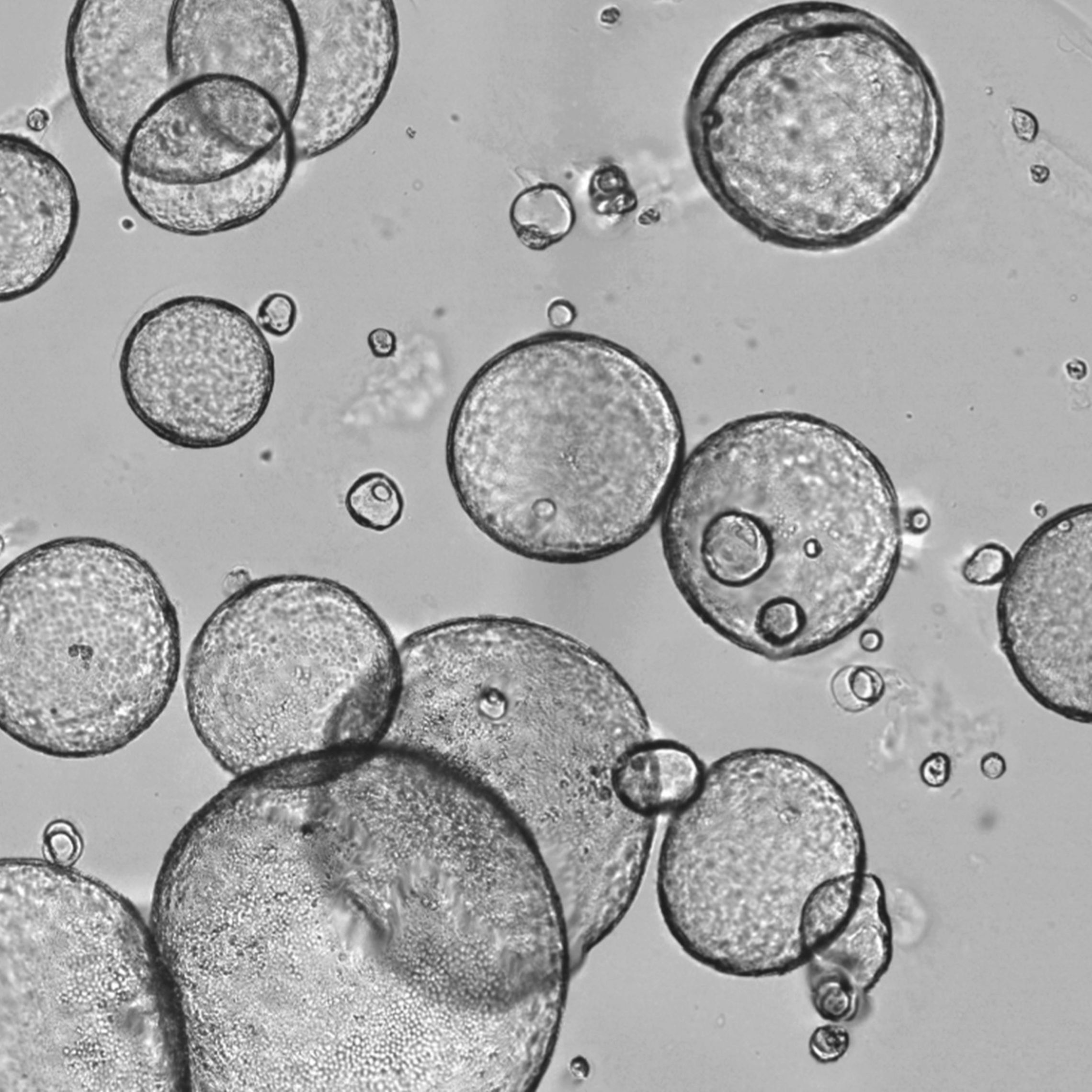 Automated Organoid Dispensing and Assay in Matrigel® Domes | Sartorius