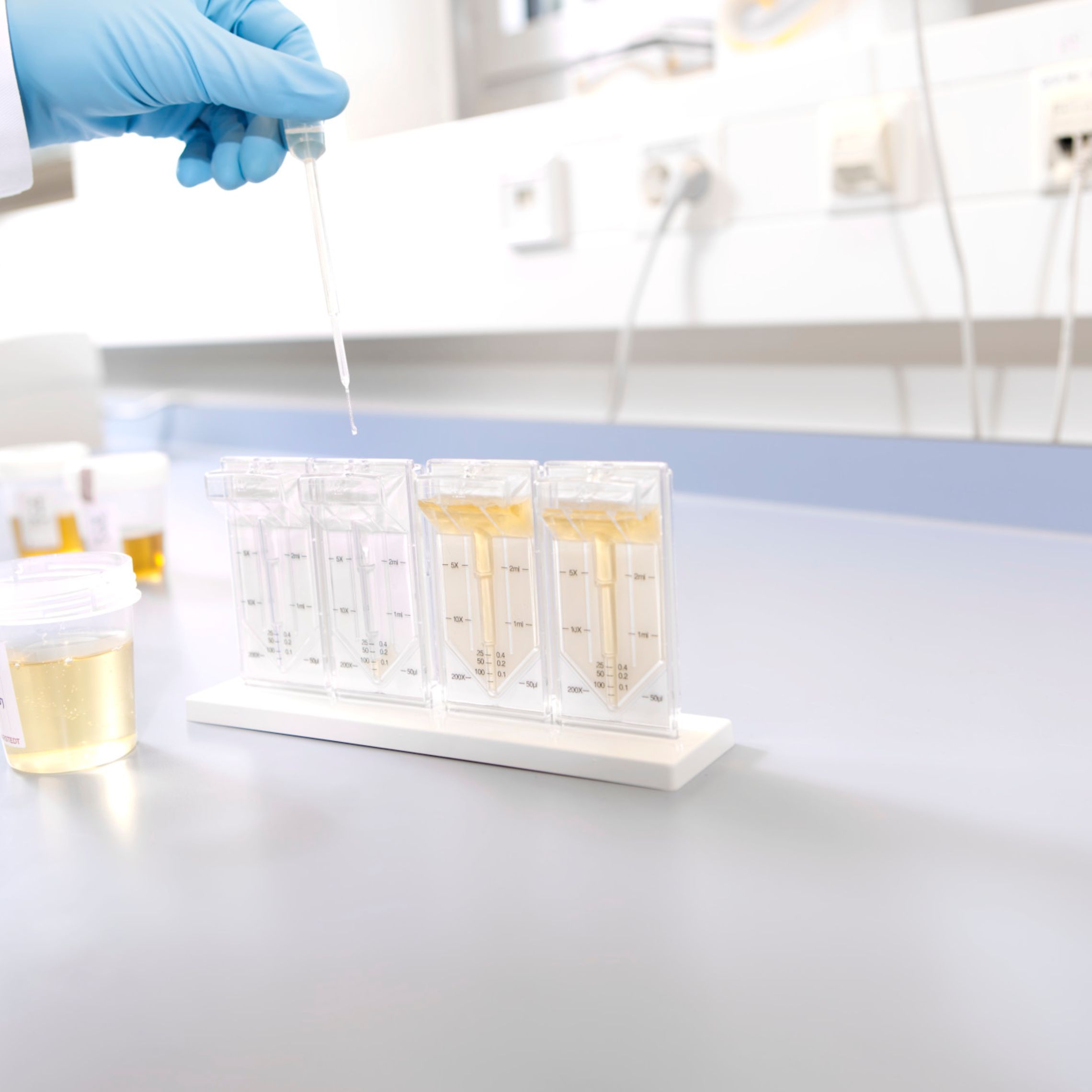 Diagnostic Sample Prep | Sartorius