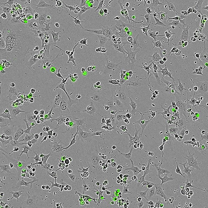 Introduction to Live-Cell Analysis for Cytotoxicity Video | Sartorius