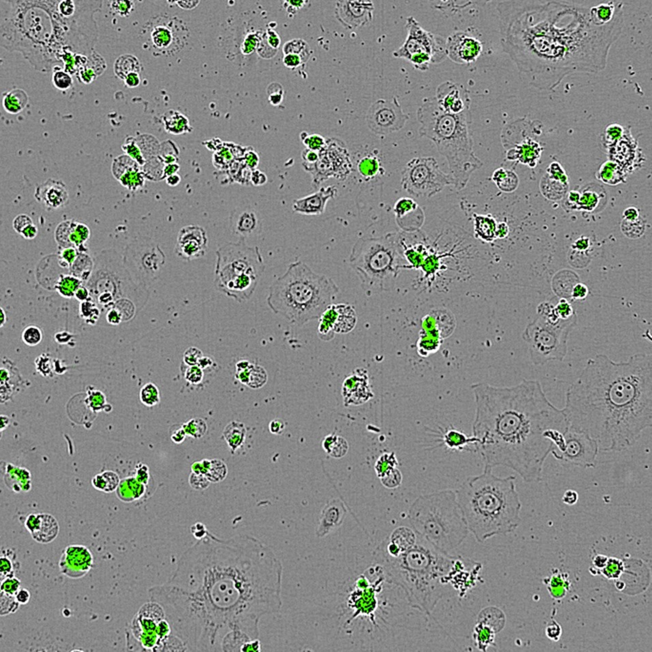 Incucyte® Apoptosis Assays for Live-Cell Analysis | Sartorius