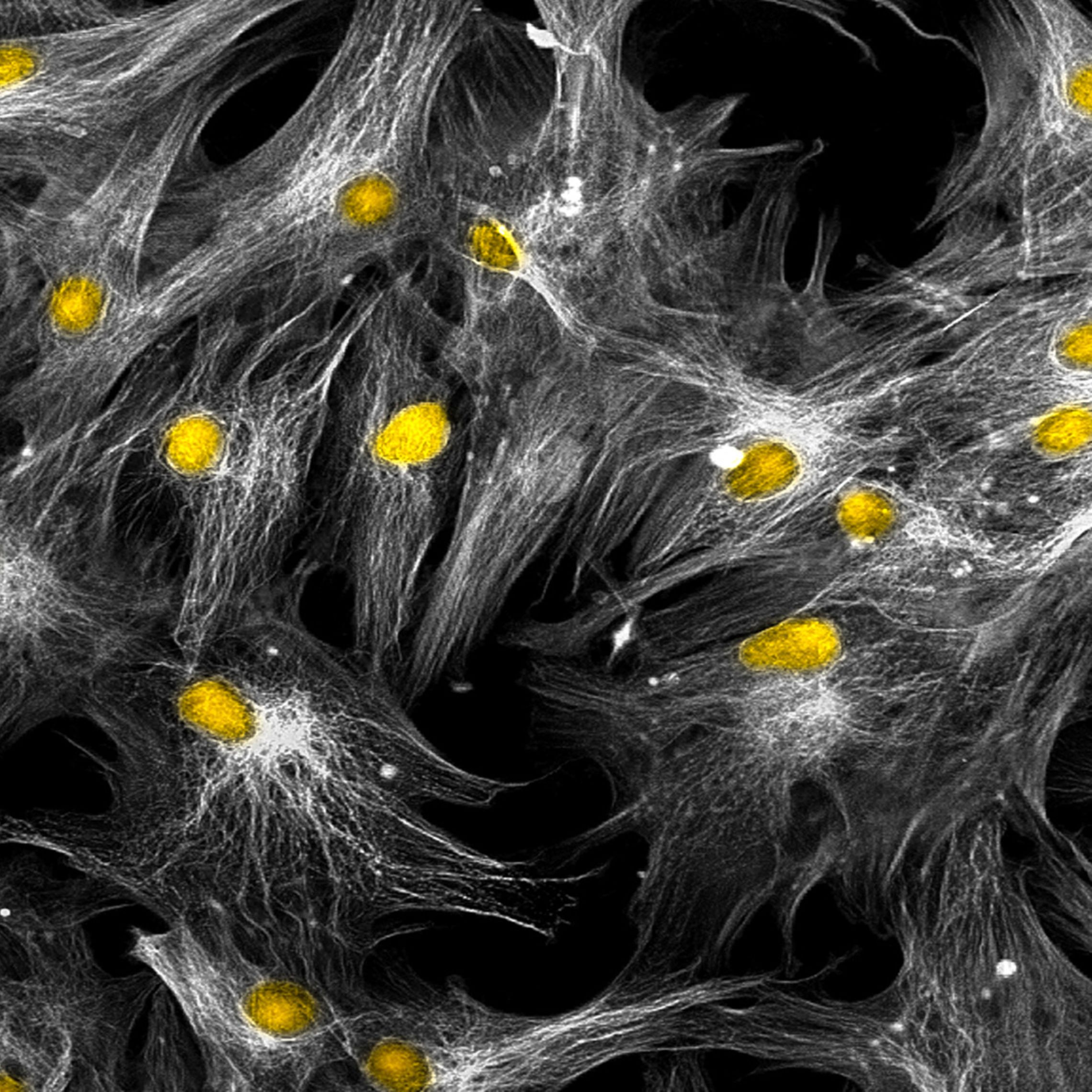 What Are hMSCs and Why They Are Ideal for Therapeutic Applications