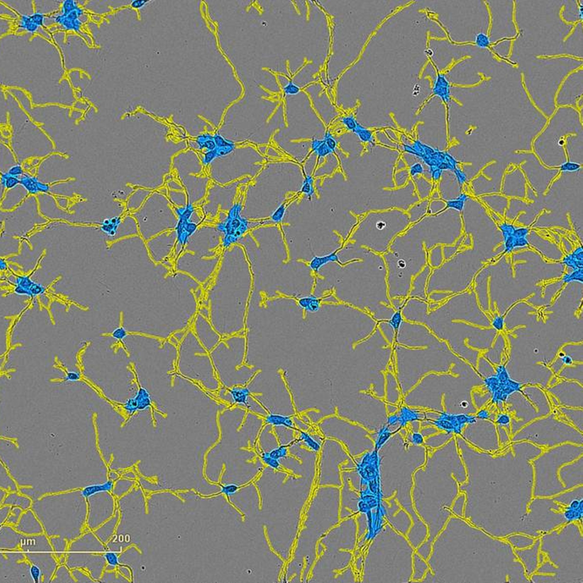 Incucyte Neurotrack Analysis Software | Sartorius
