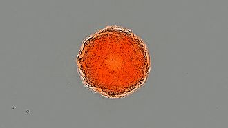 Natural Killer Cells | Sartorius