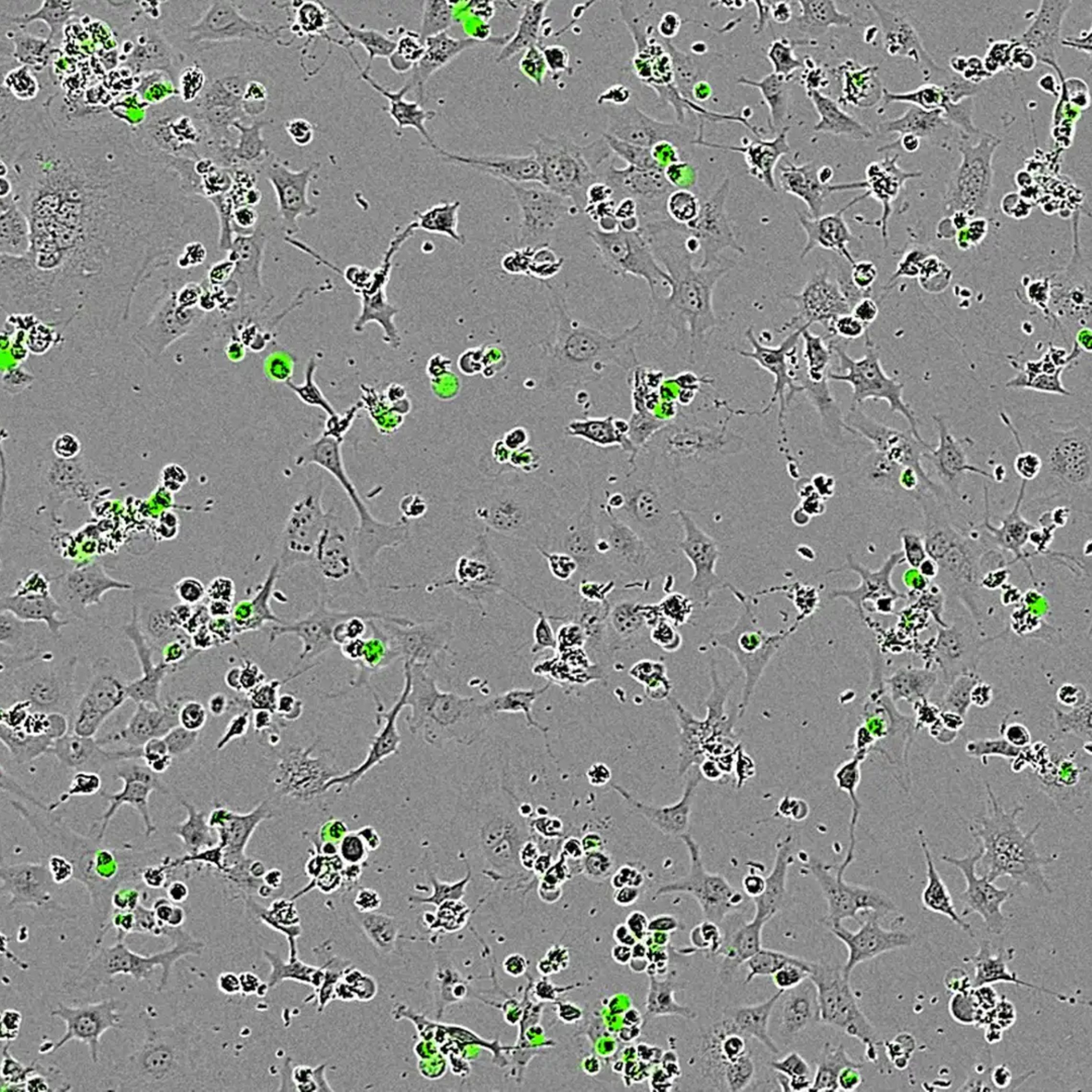 Incucyte® Cytotoxicity Assays for Live-Cell Analysis | Sartorius