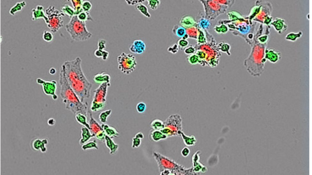 Natural Killer Cells | Sartorius