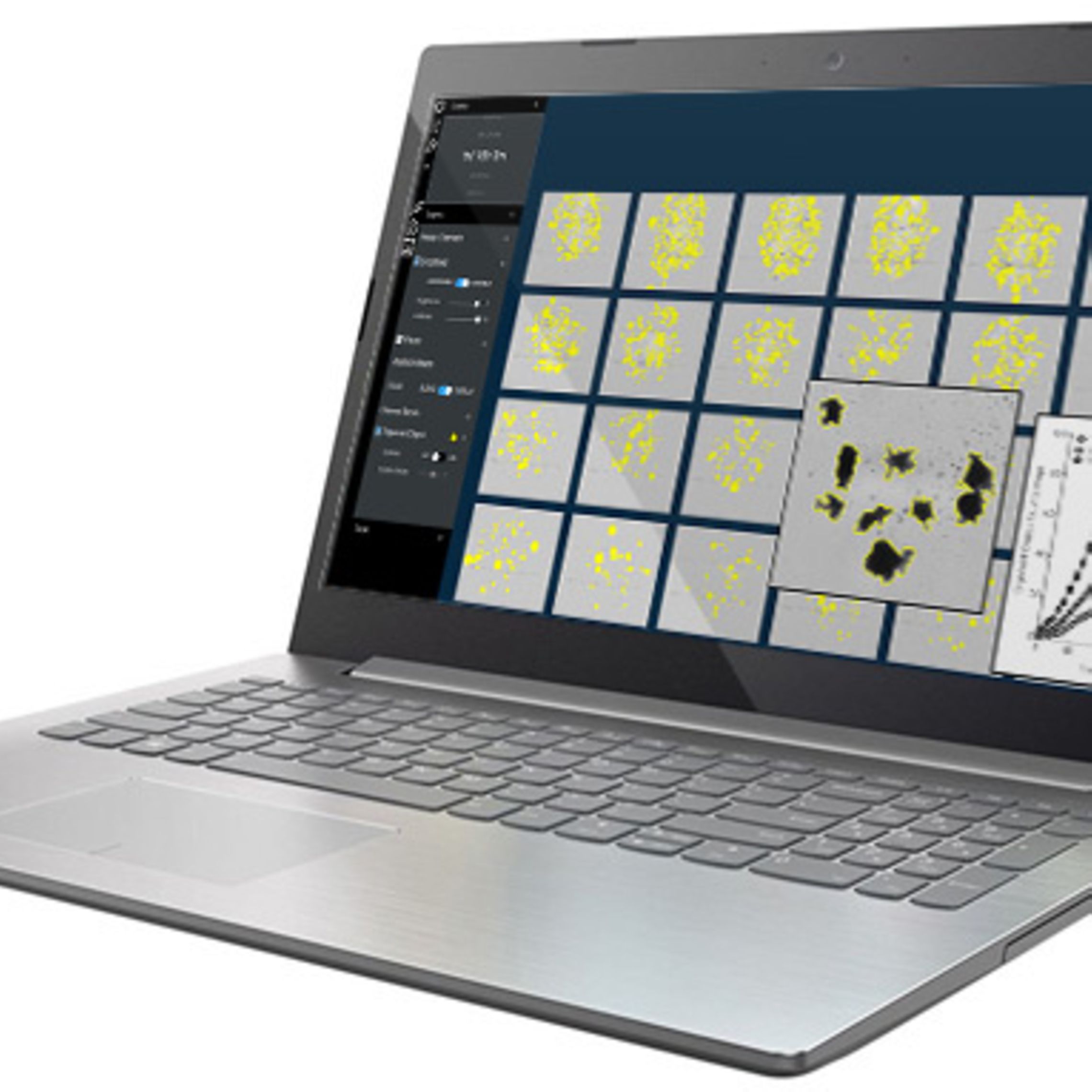 Incucyte Organoid Analysis Software | Sartorius