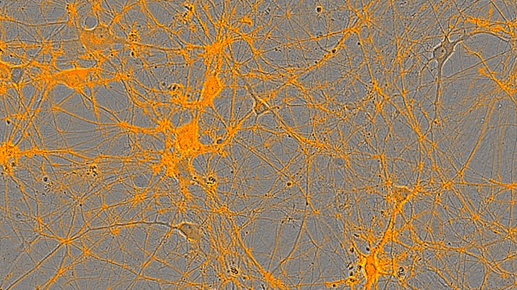 Neuronal Cell Health & Morphology | Sartorius