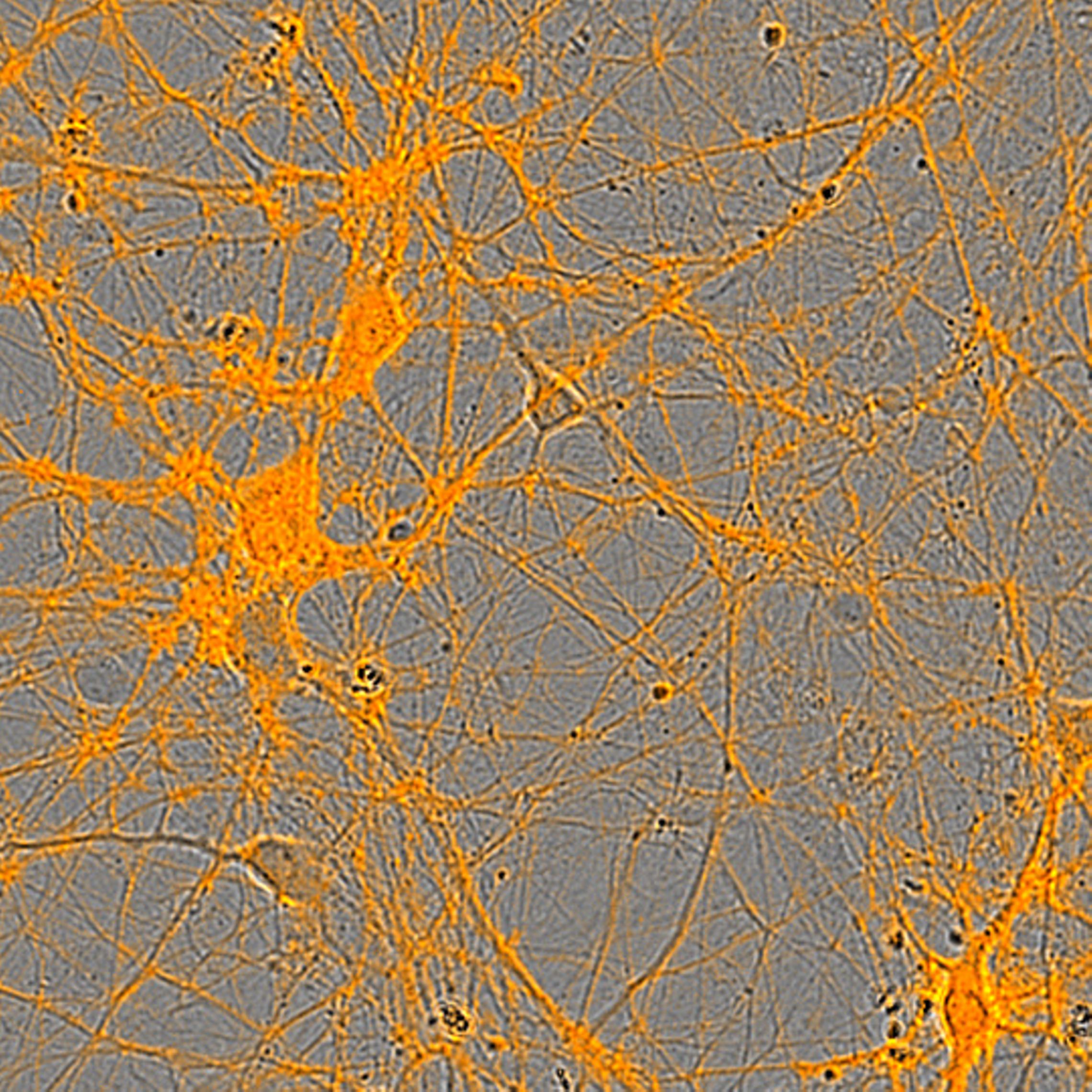 Neuronal Cell Health & Morphology | Sartorius