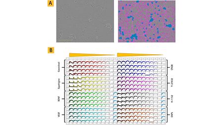 Neuronal Cell Health & Morphology | Sartorius