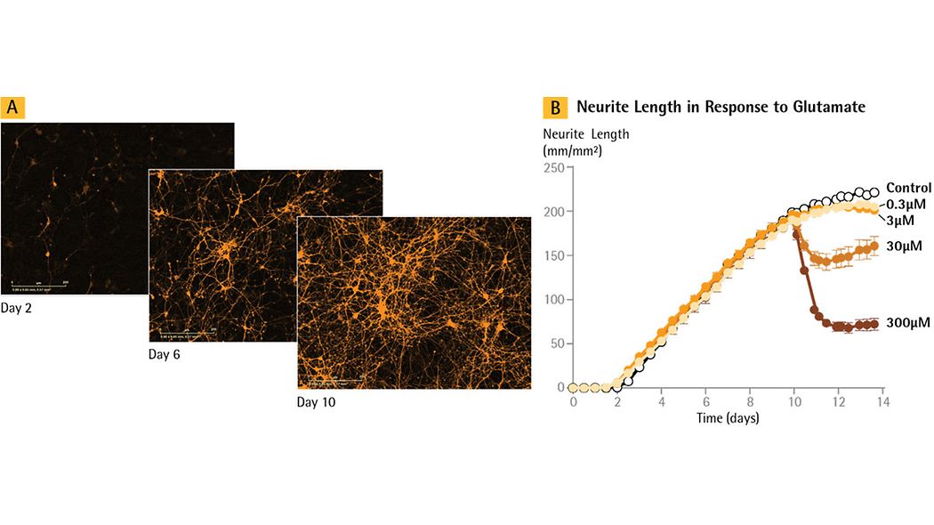 Neuronal Cell Health & Morphology | Sartorius