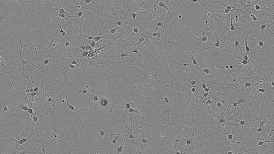 Neurite Outgrowth | Sartorius