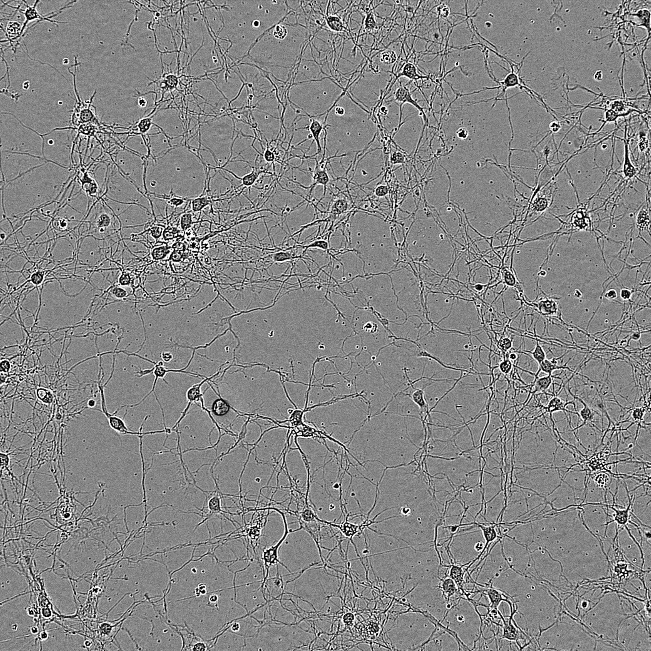 Neurite Outgrowth | Sartorius