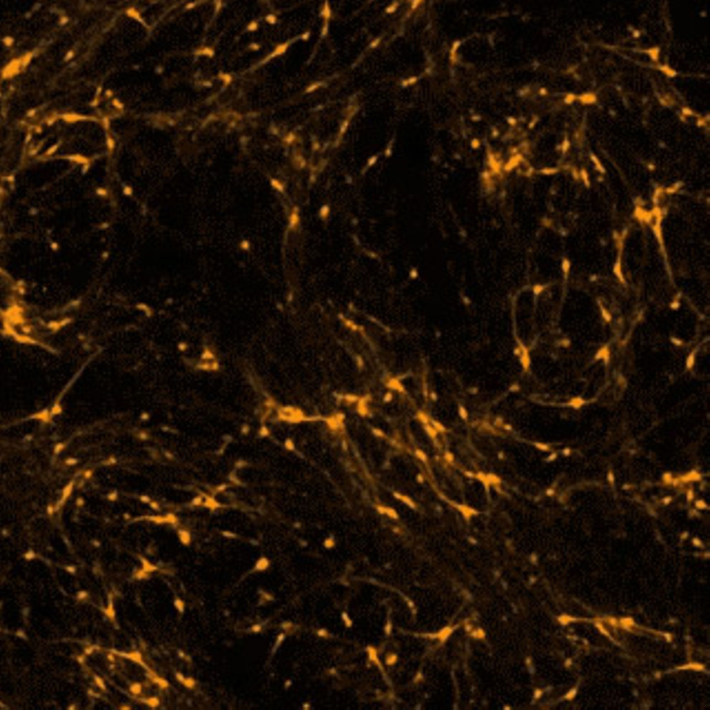 Neuronal Activity | Sartorius