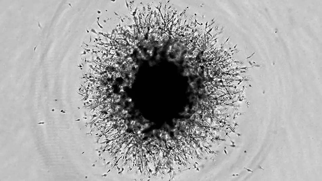 Neuro-Oncology | Sartorius