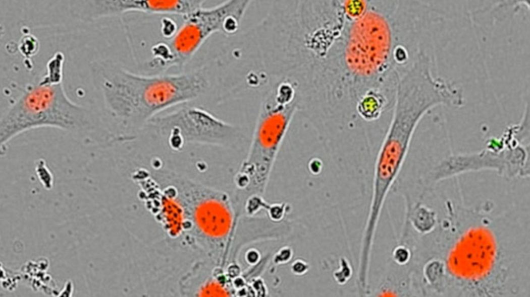 Cell Therapy: Live-Cell Analysis of Immune Cell Killing, Activation ...