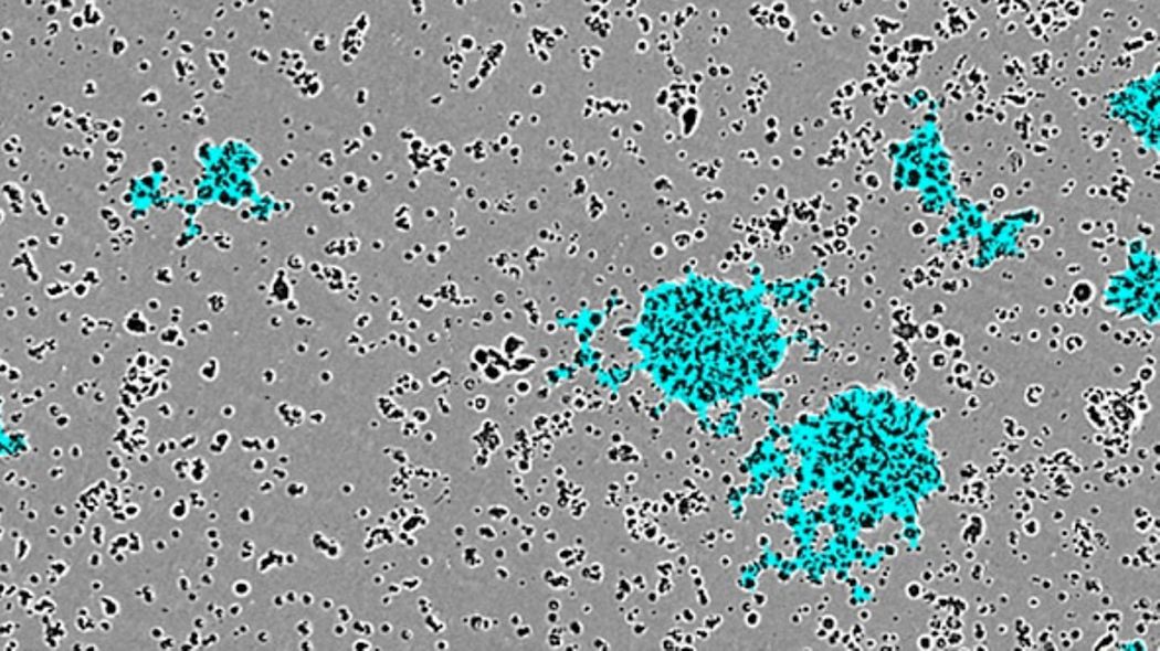 Cell Therapy: Live-Cell Analysis of Immune Cell Killing, Activation ...