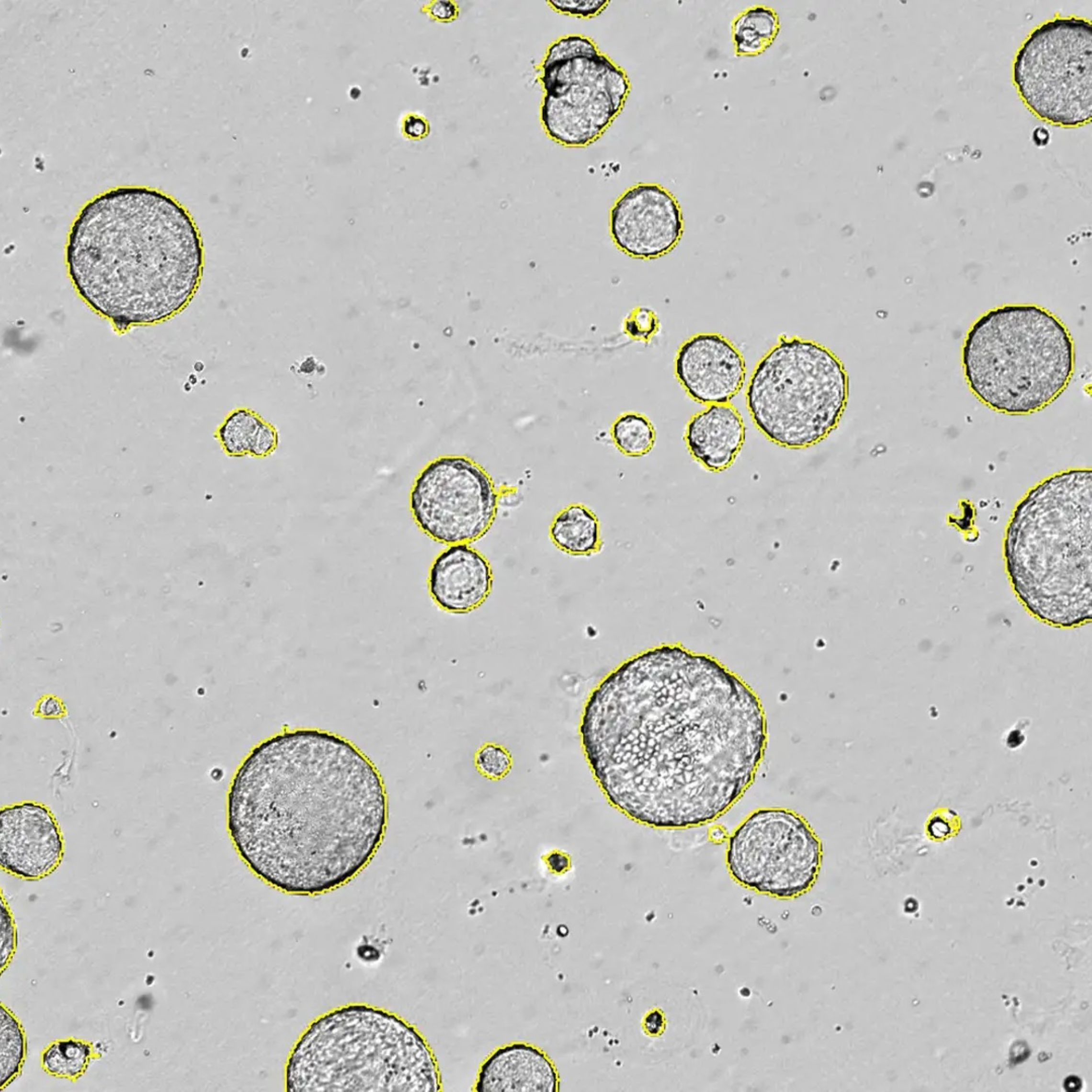 Organoid Assay | Sartorius