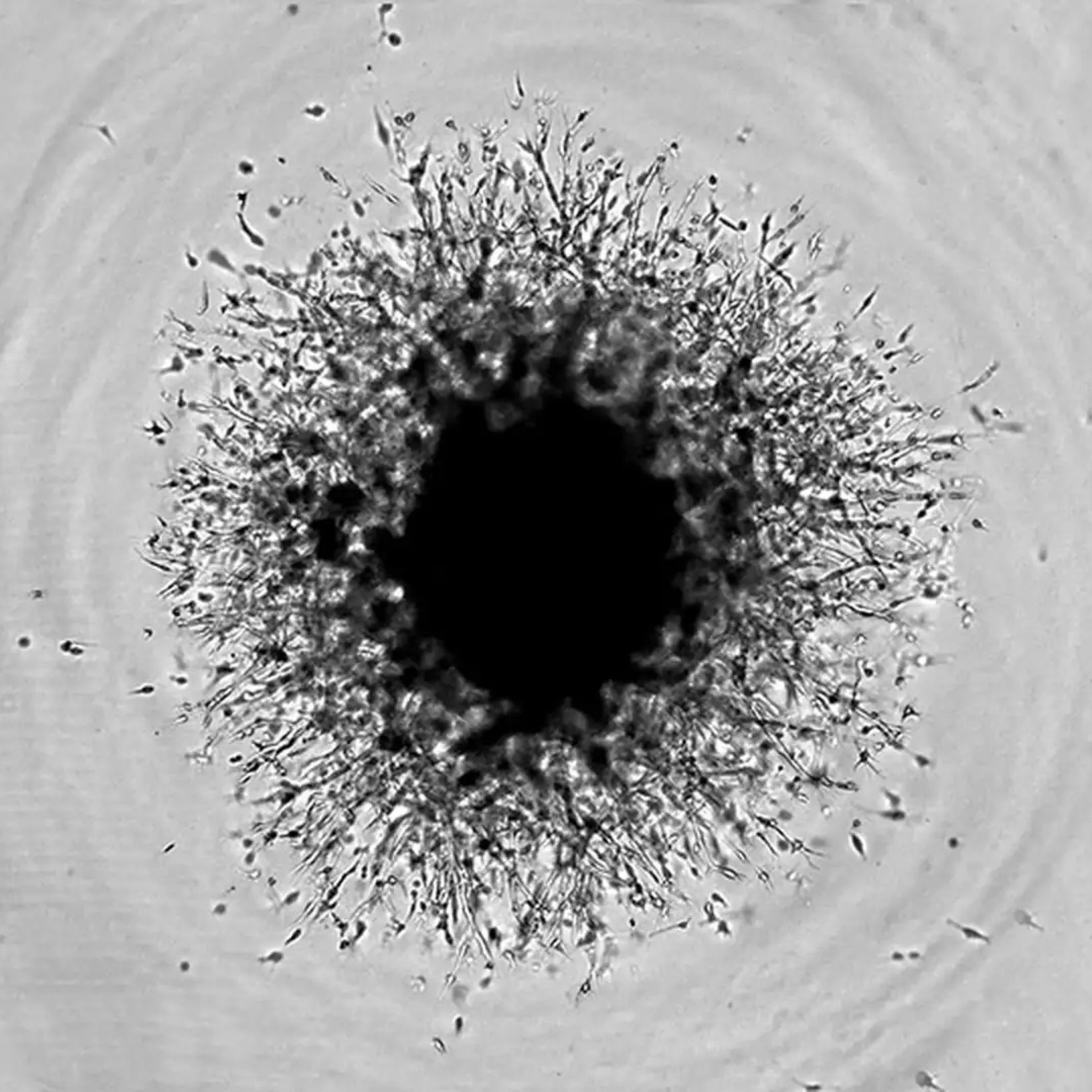 Spheroid Invasion | Sartorius
