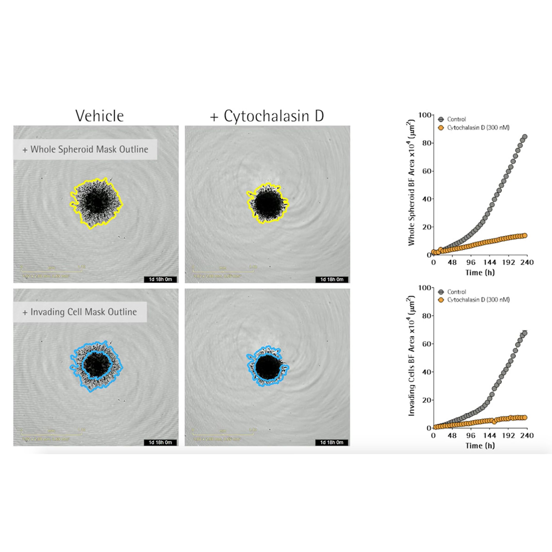 Spheroid Invasion | Sartorius