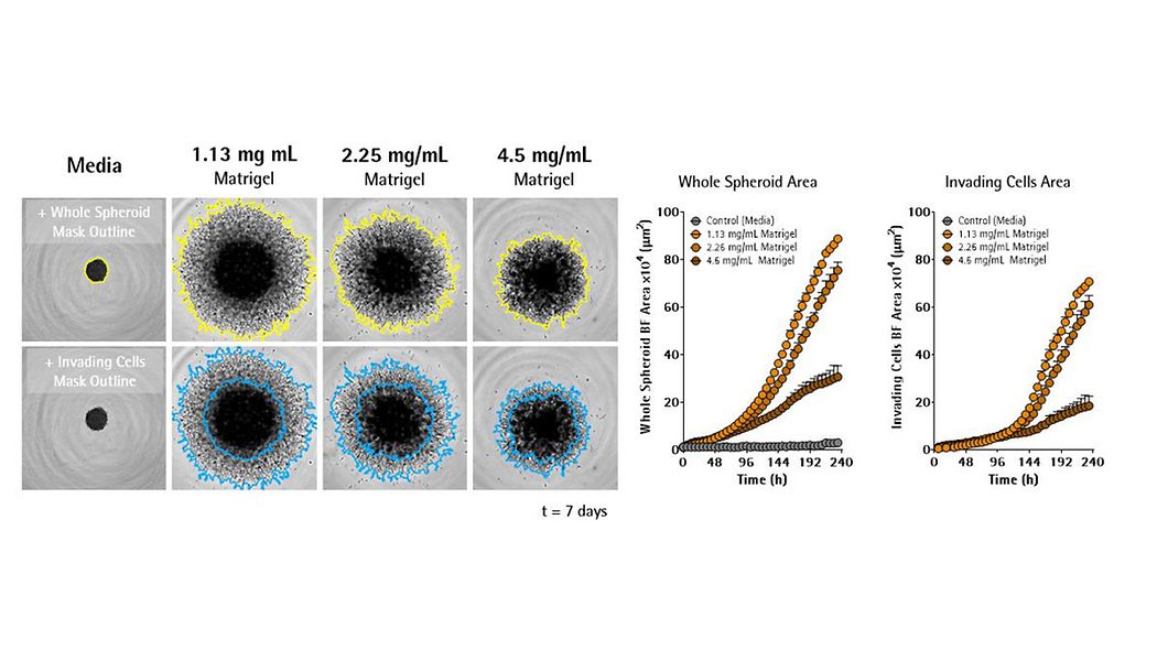 Spheroid Invasion | Sartorius
