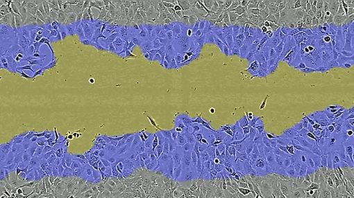 Incucyte Cell Migration Scratch Wound Analysis | Sartorius