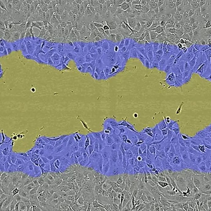 Scratch Wound Migration & Invasion | Sartorius