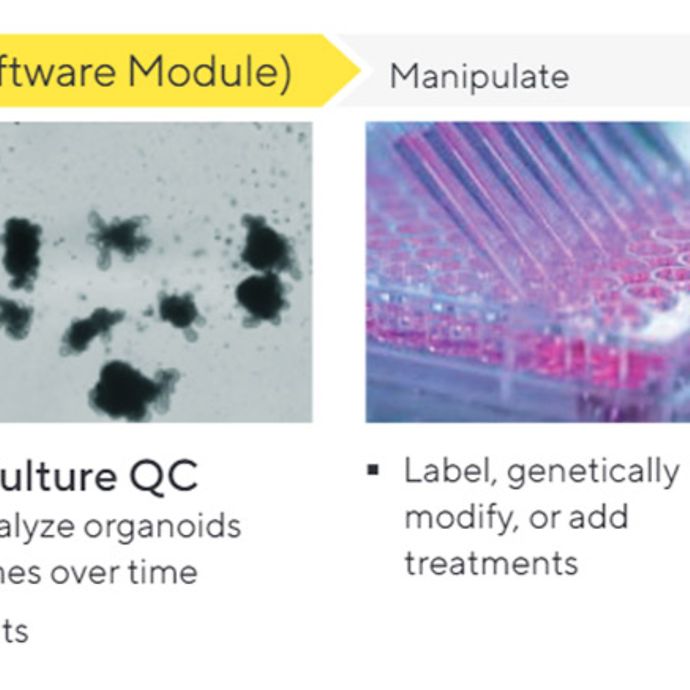 Incucyte Organoid Analysis Software | Sartorius